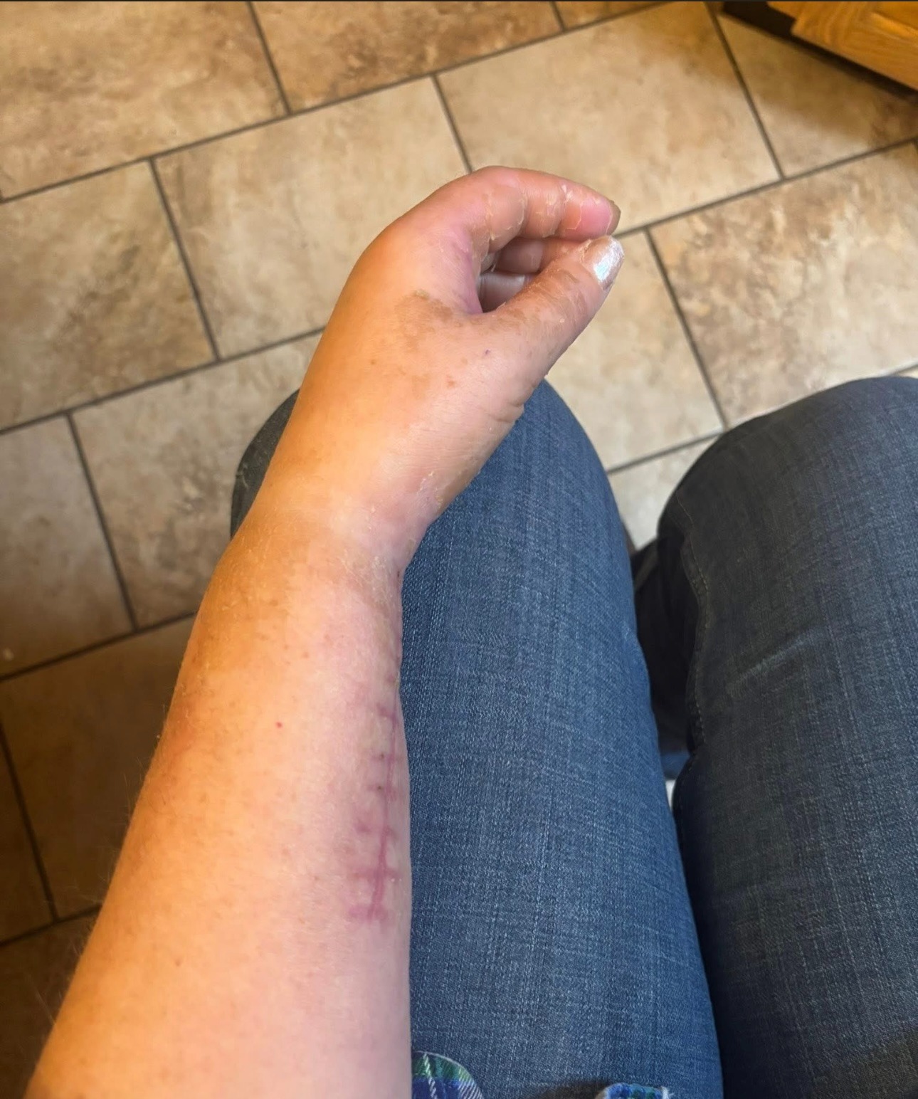 Fundraiser for Vicki Long by Abigail Dahlin : Help Vicki Cover Medical ...