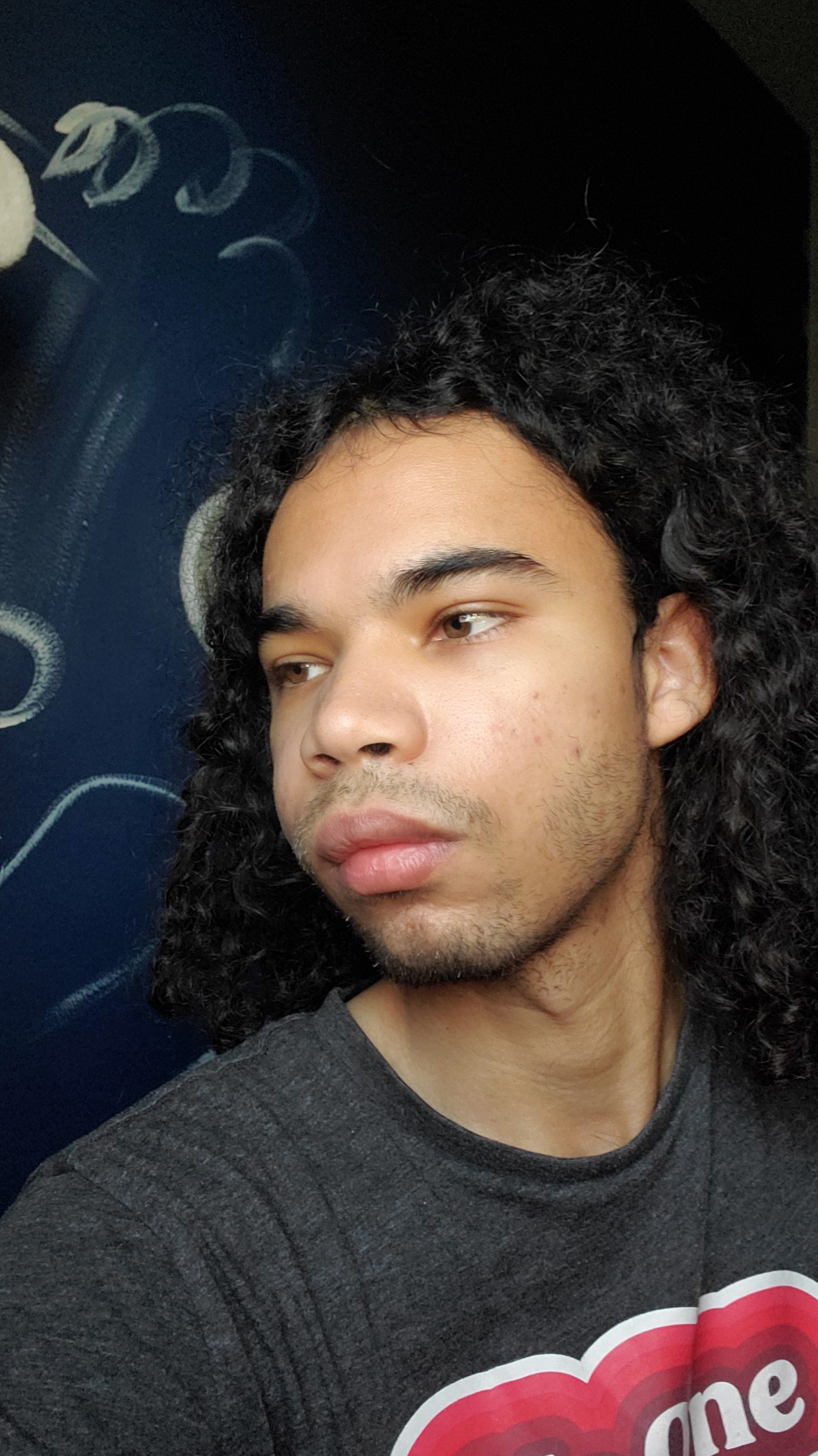 Fundraiser by Corey Braggs : Emergency Dental Help Needed for Corey