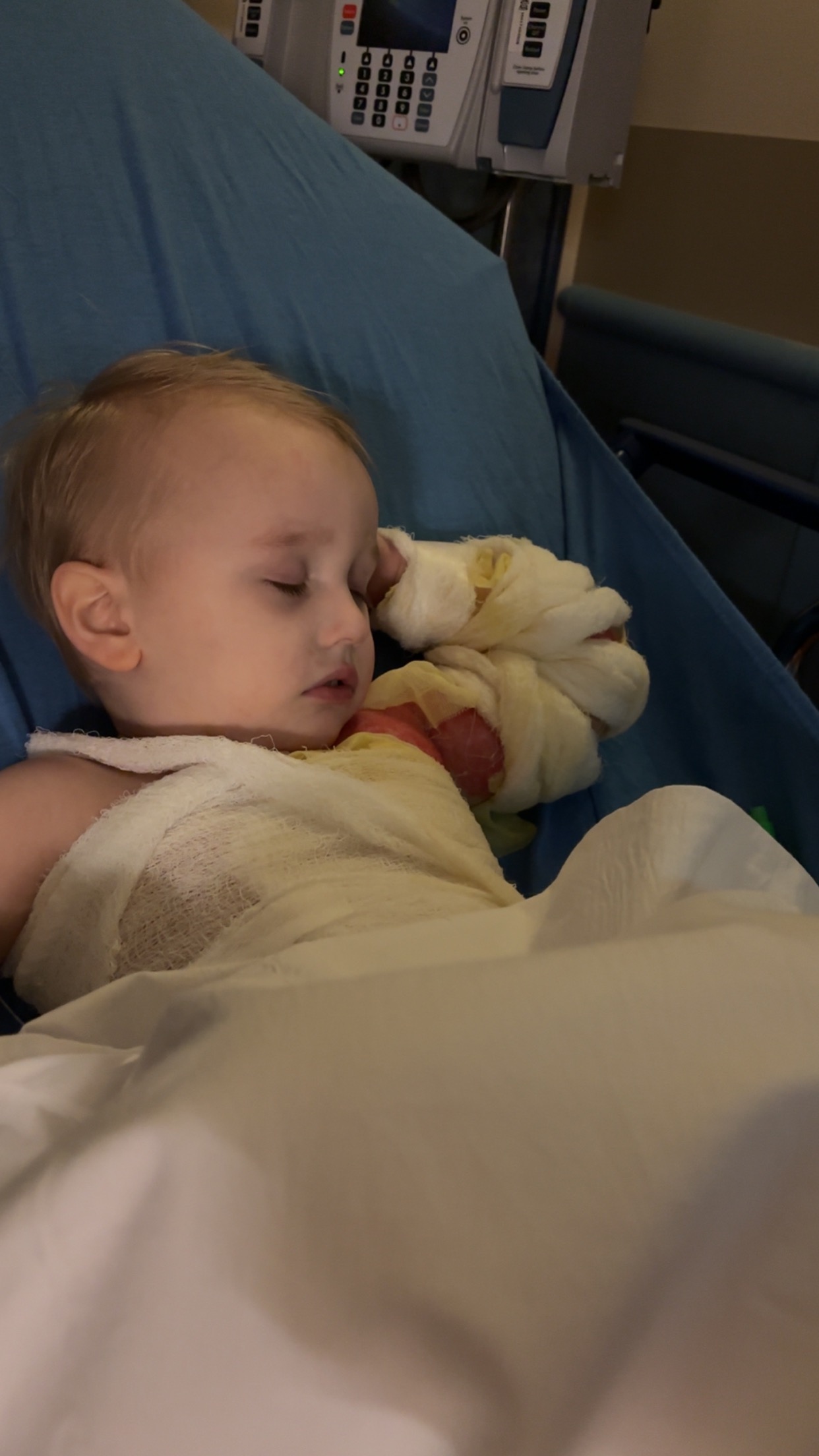 Fundraiser by Erin Beach : Help Karson Heal After Severe Burns