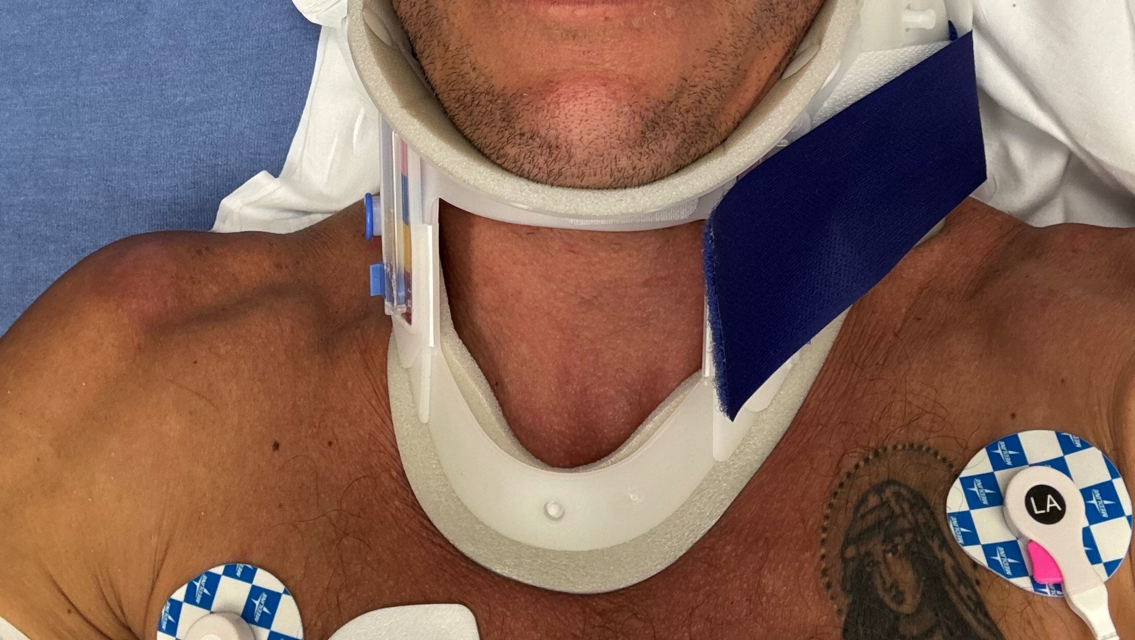 Fundraiser by Doug Gialluca : Help D Heal and Get Back to Sculpting art