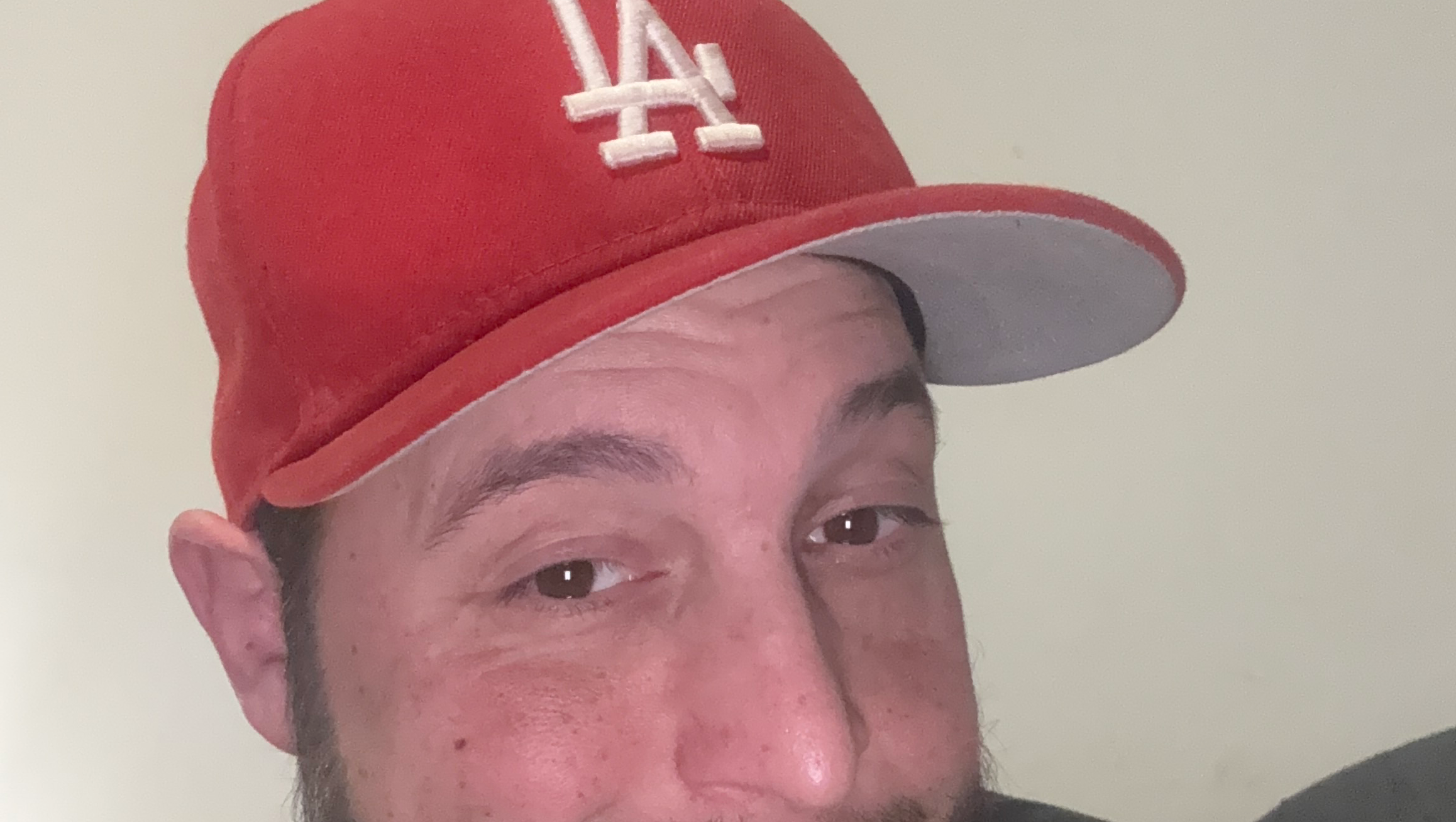 Fundraiser by Cory Johnson : Help With Recovery