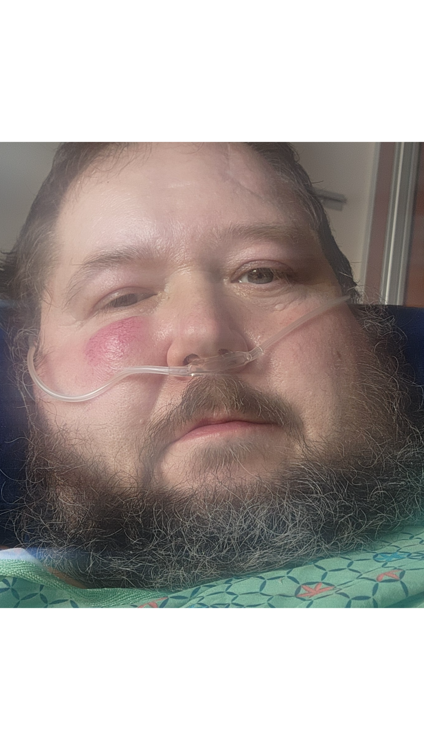 Fundraiser by Daniel Tyler : Help Daniel Tyler with Medical Bills and Care