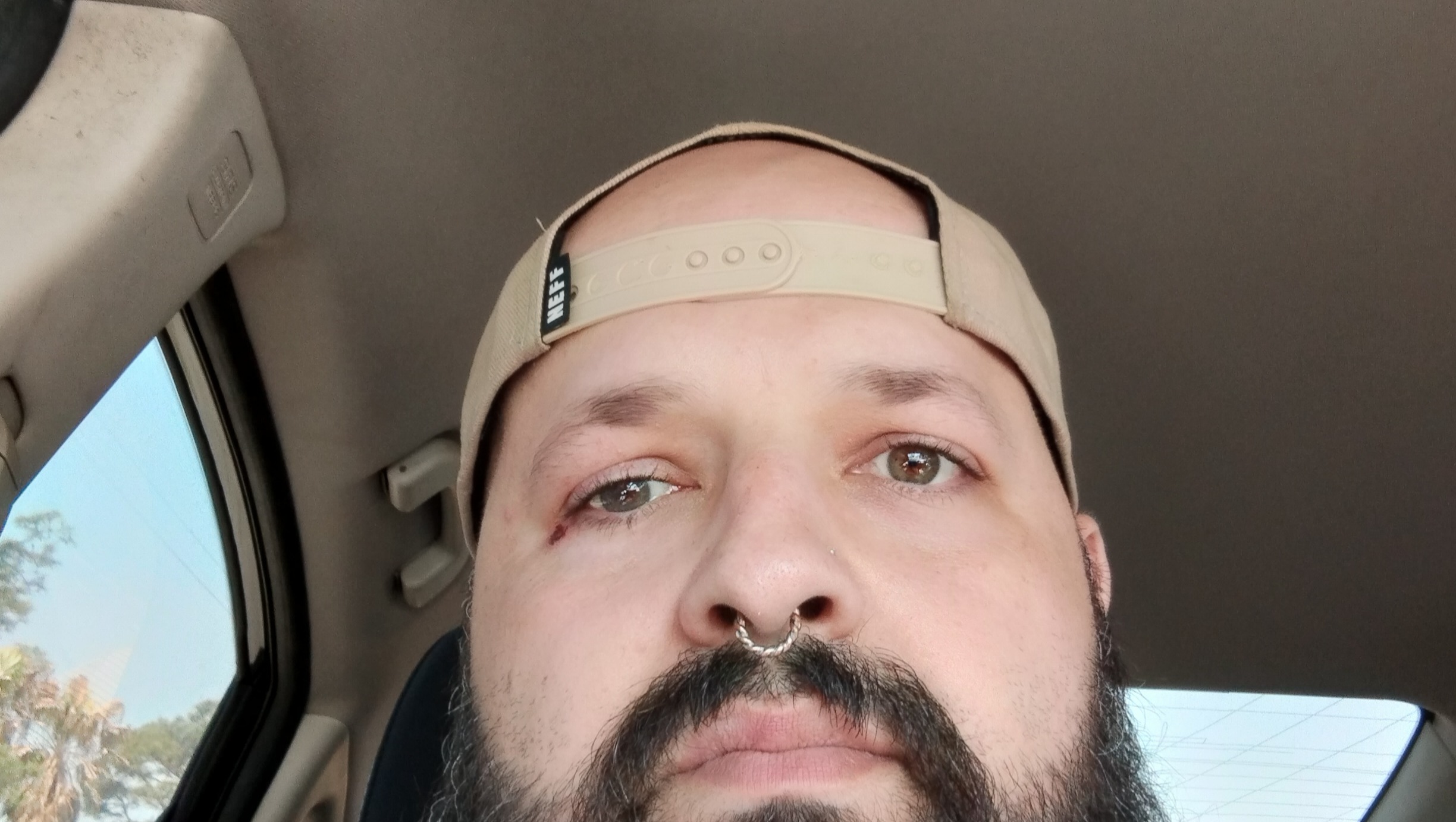Fundraiser by Justin Hayes : Support Justin’s Journey to Restore His Vision