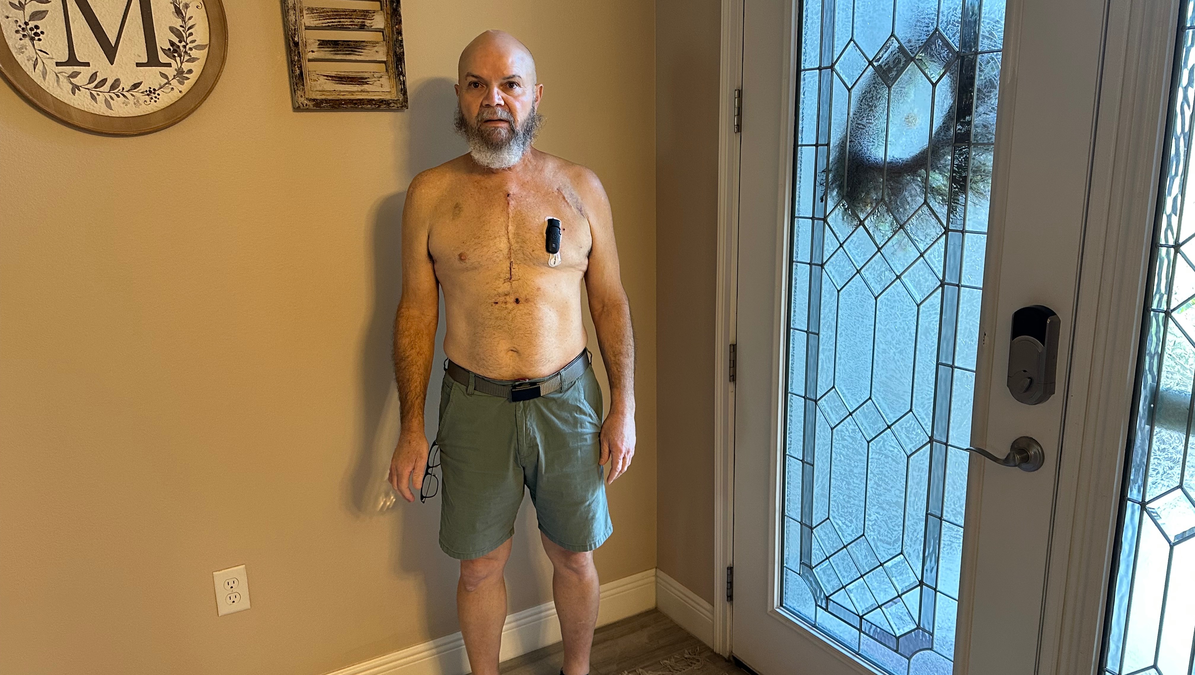 Fundraiser by mike Booker : Support Jose’s Heart Transplant Recovery