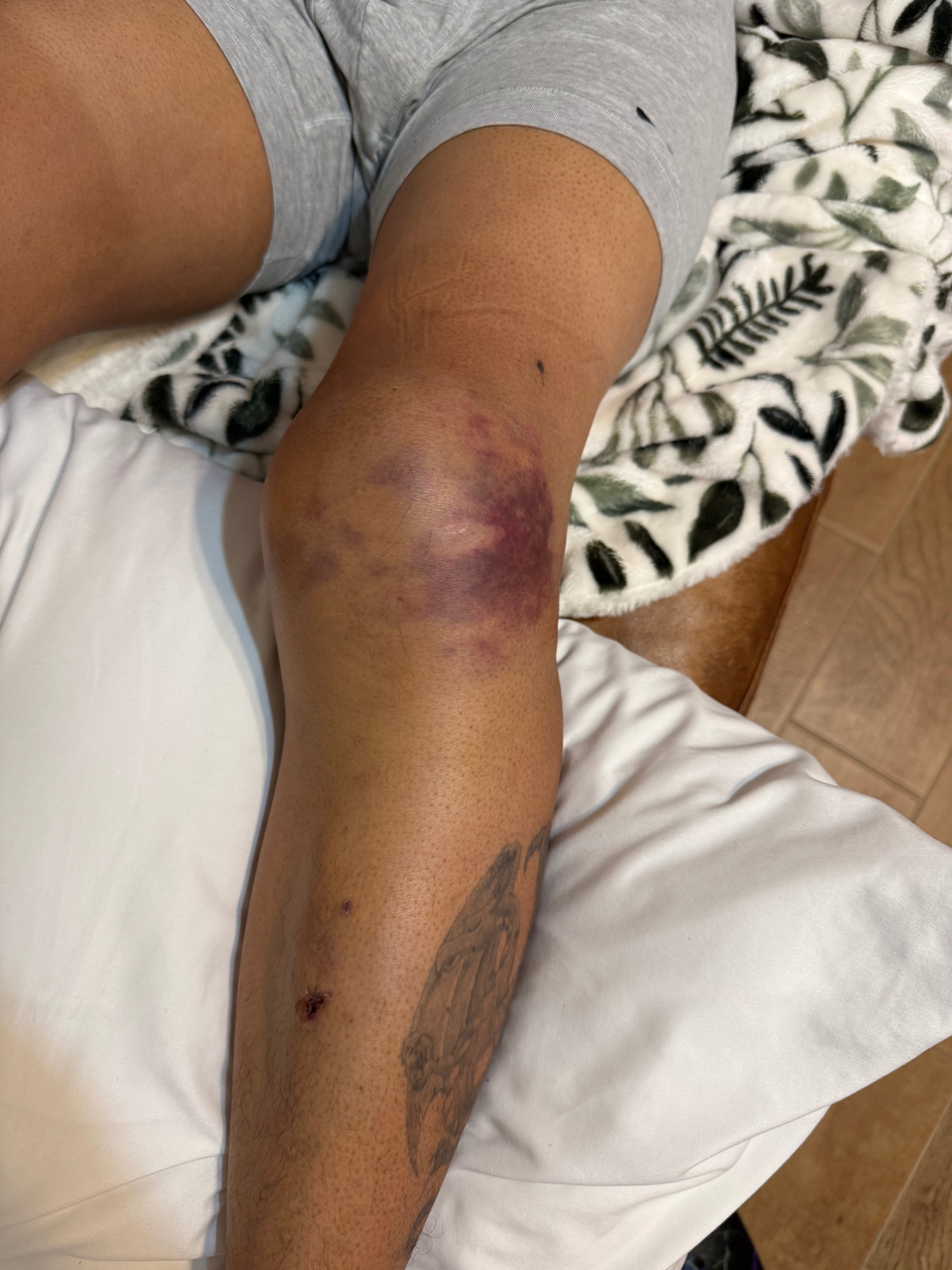 Fundraiser by Gabriel Chavez : Help Jhonatan & Maylin Recover After ...