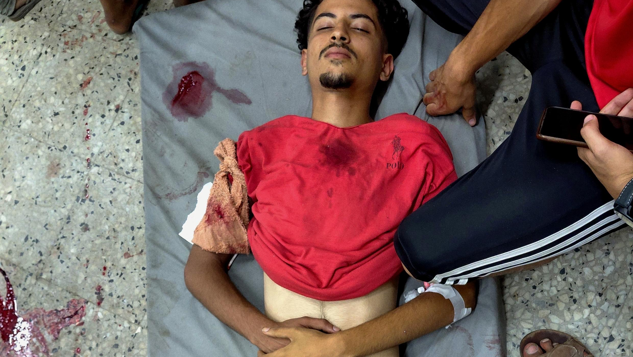 Fundraiser by Amer Meqdad : My Body Is Full of Shrapnel… But I'm Still ...