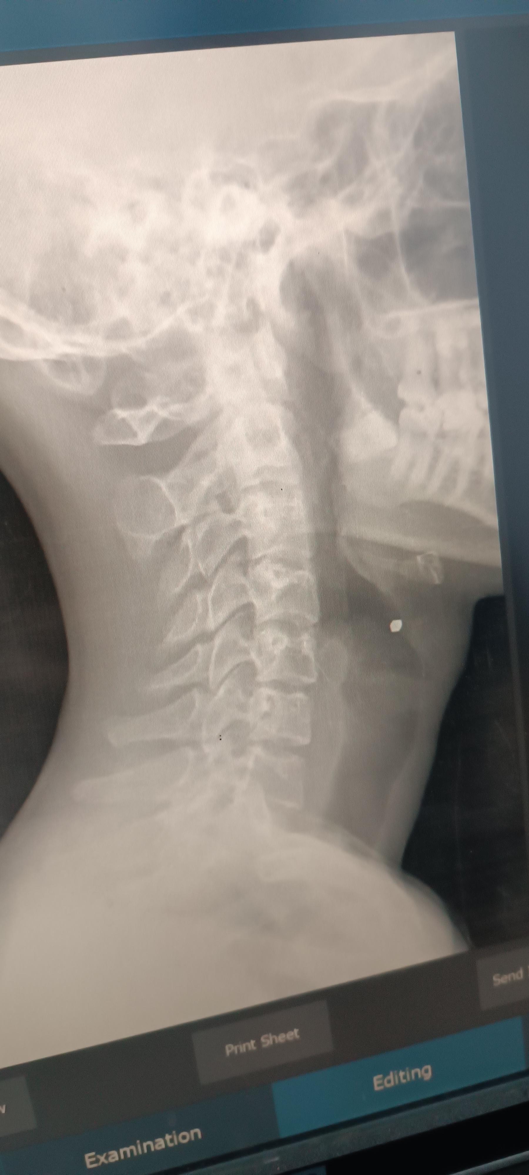 Fundraiser by Amer Meqdad : My Body Is Full of Shrapnel… But I'm Still ...