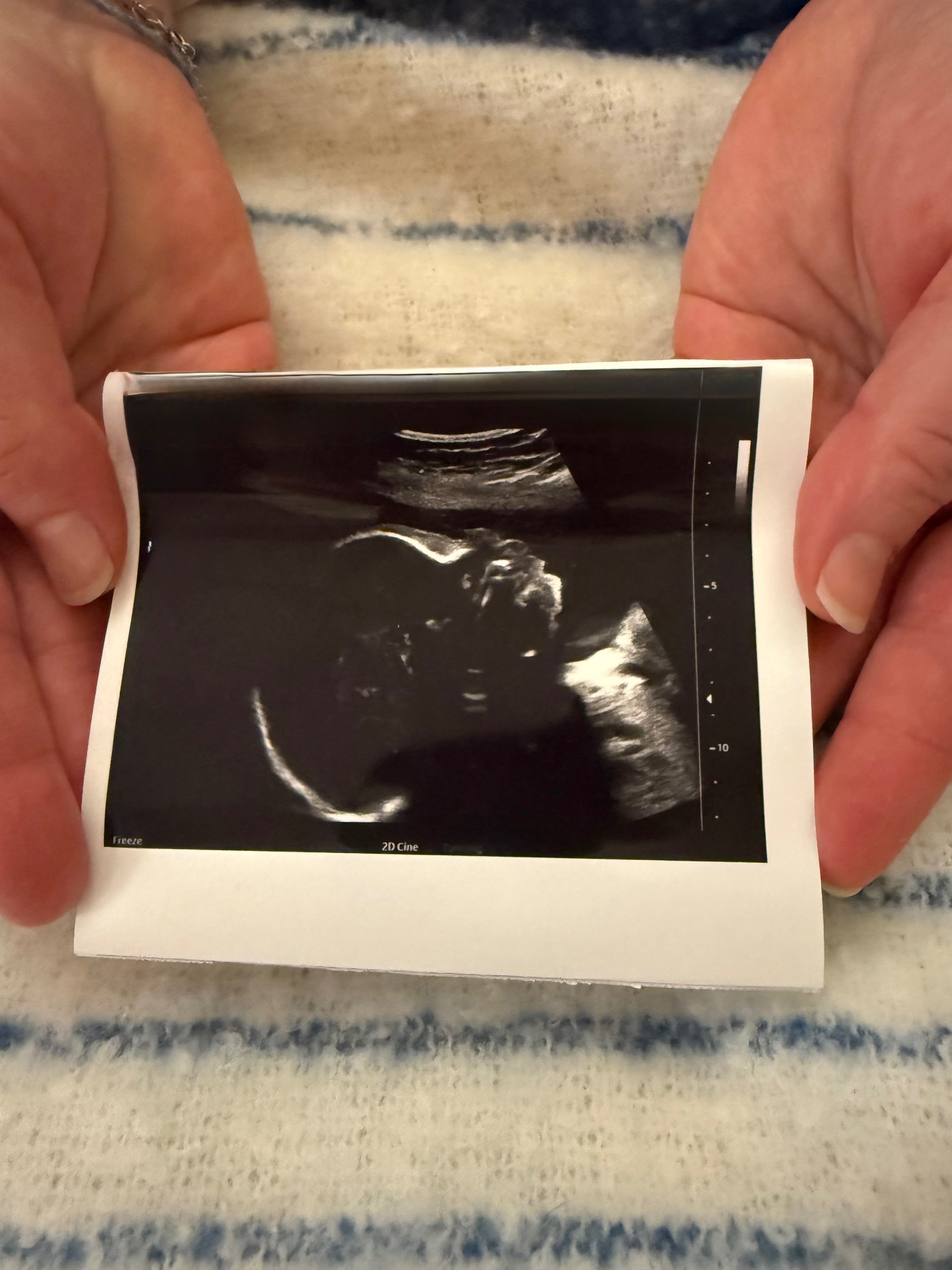 Fundraiser by April Riddle : Support for Chelsea’s Family & Early Arrival