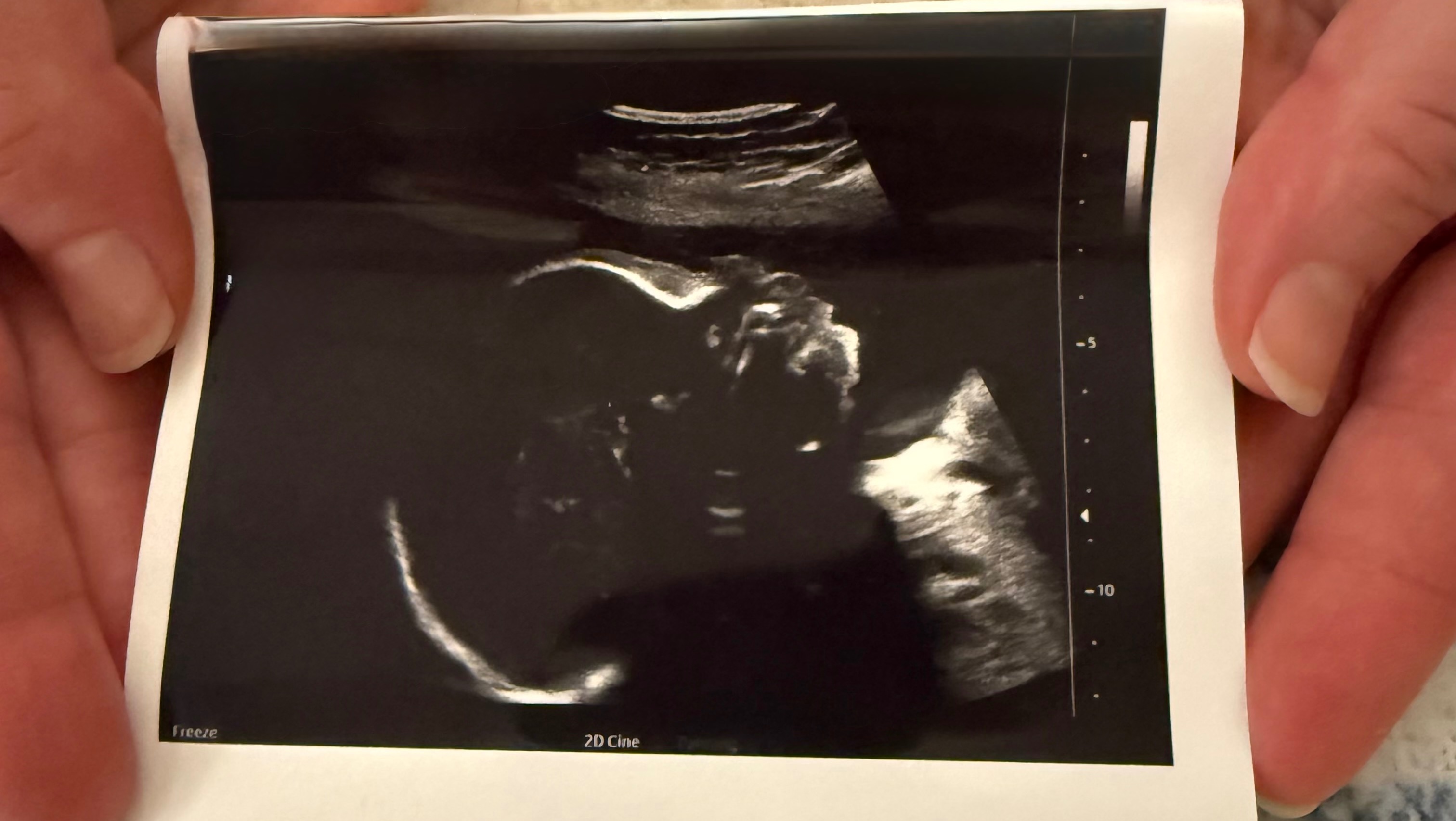 Fundraiser by April Riddle : Support for Chelsea’s Family & Early Arrival