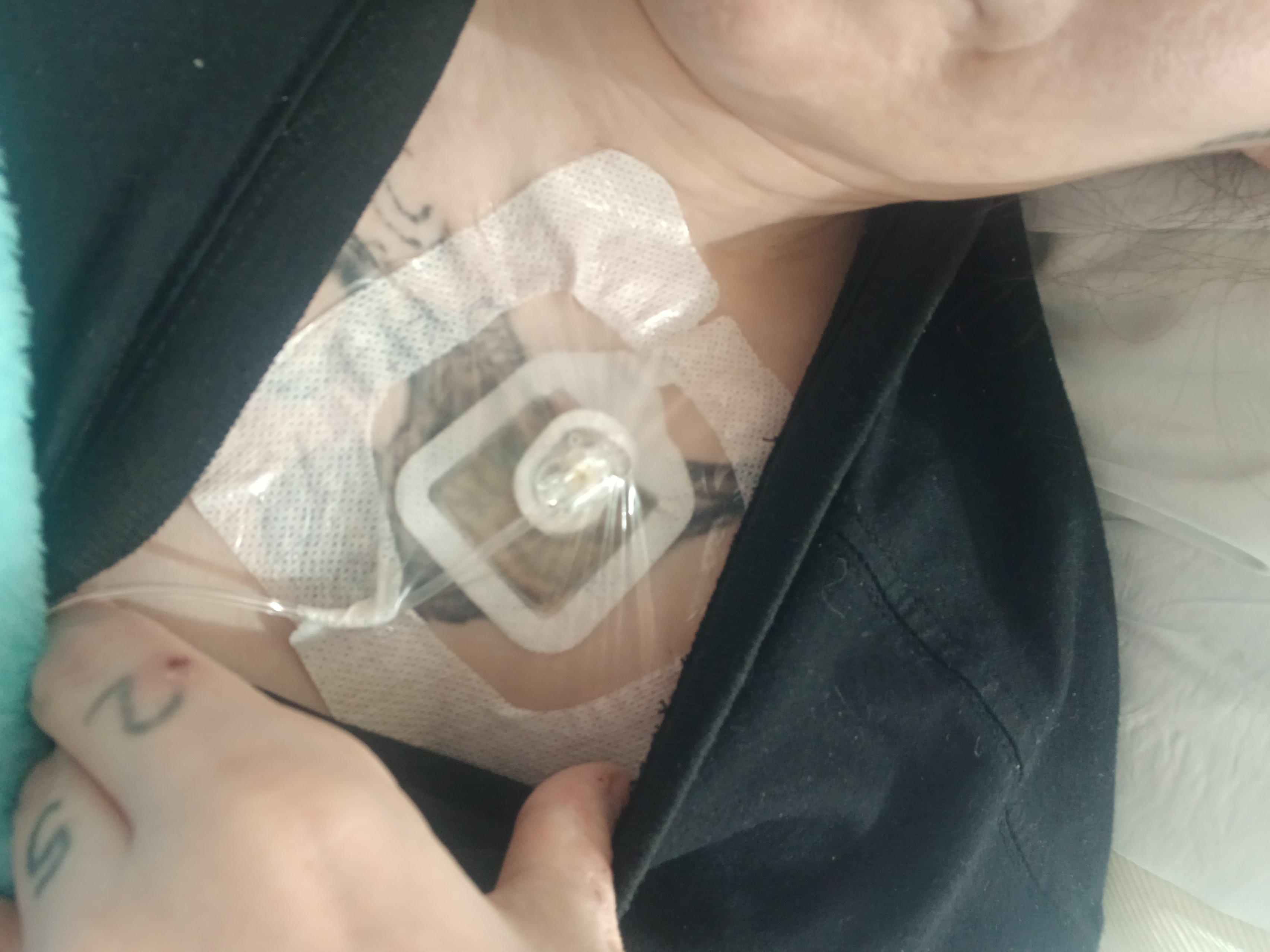 Fundraiser by Tim Anthony Hampton : Help Erica Battle Metastatic ...