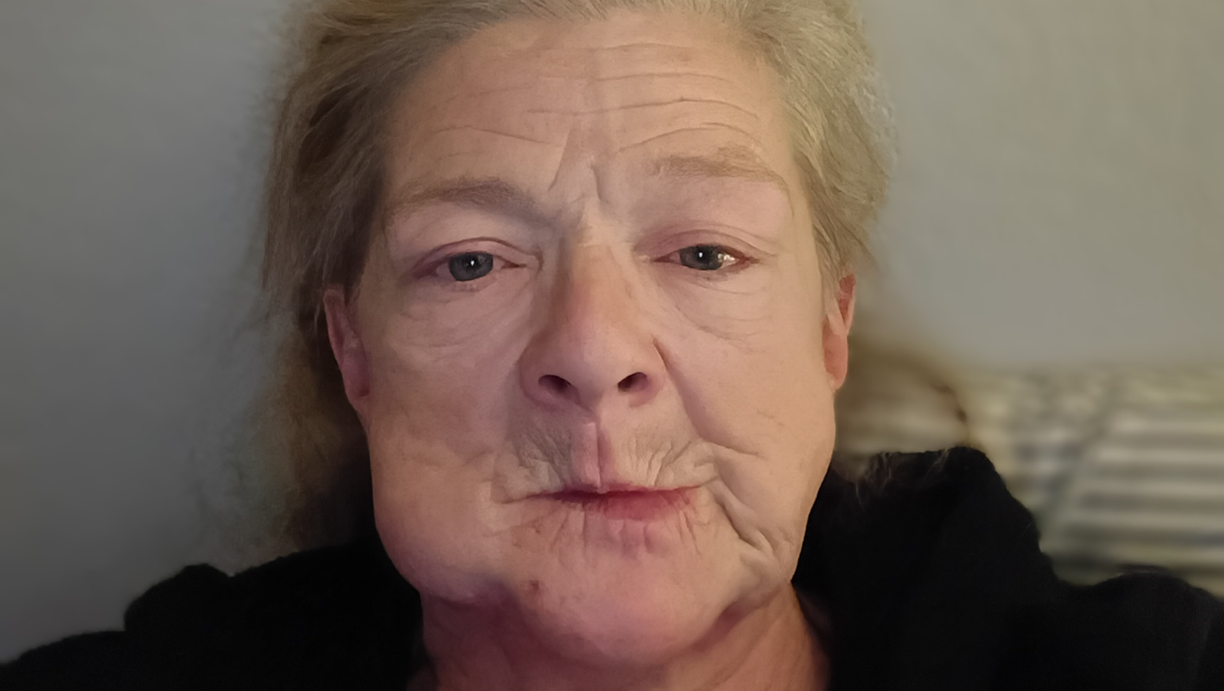 Fundraiser for Dillon Vance by Julia Vance : Help Julia Rebuild Her Jaw ...