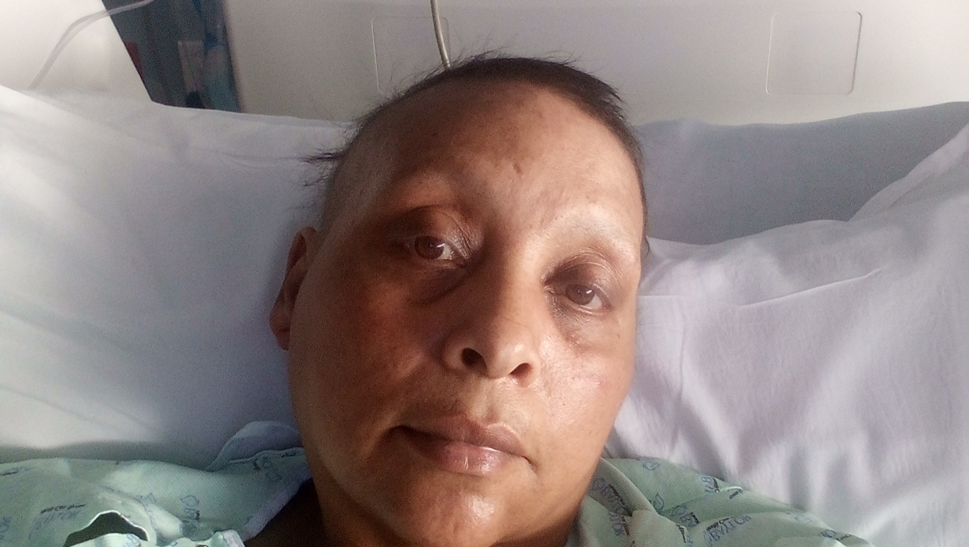 Fundraiser by Barbara Villa : need help with treatment and bill please help