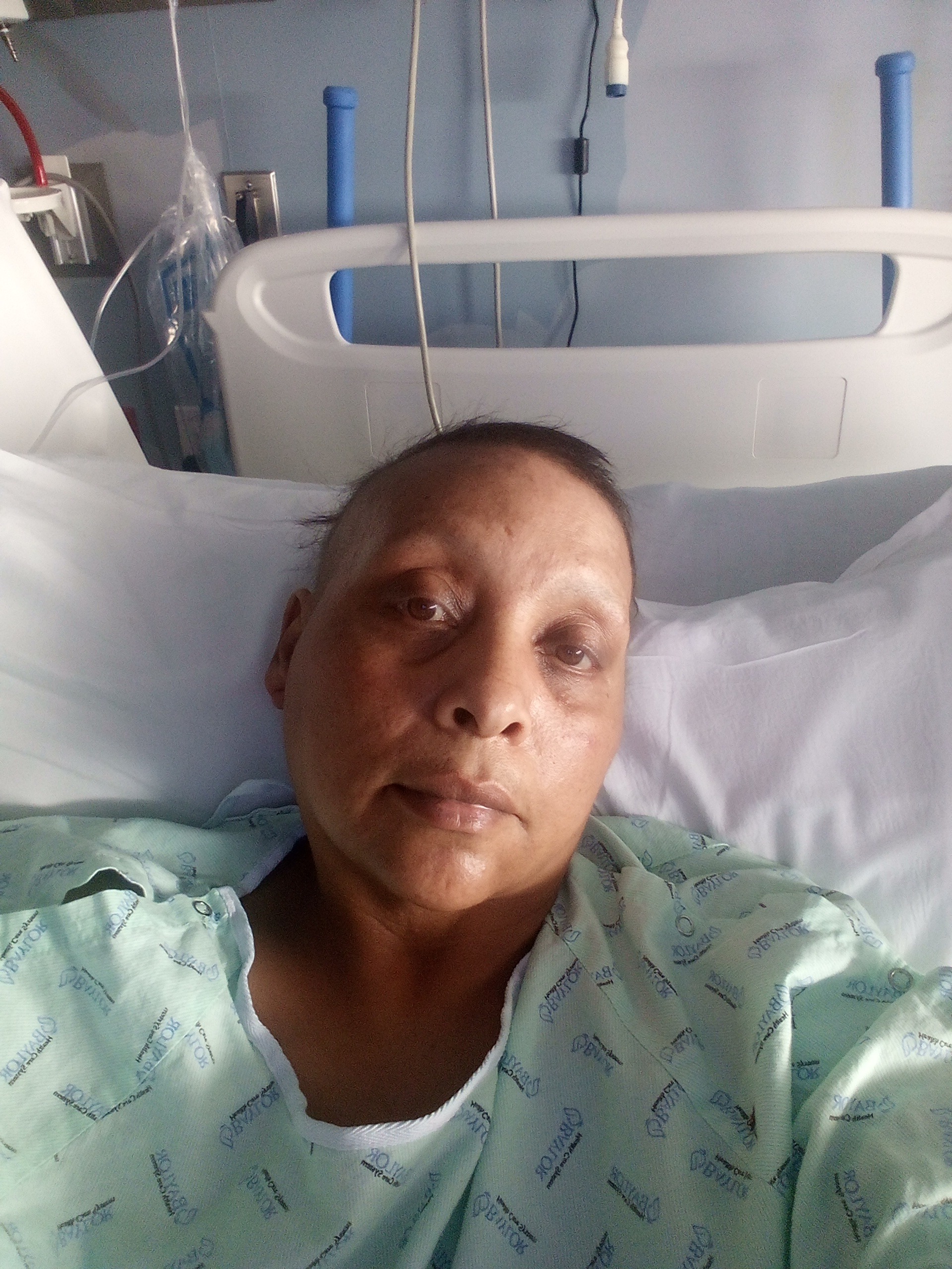 Fundraiser by Barbara Villa : need help with treatment and bill please help