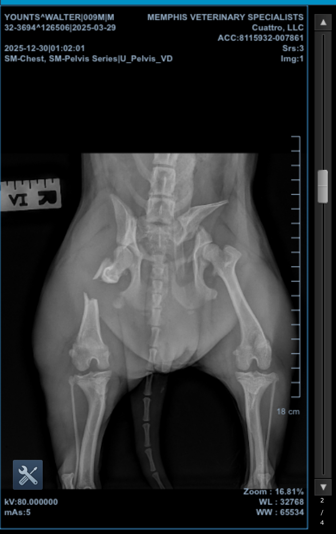 Fundraiser by Kimber Rahm : Get Walter Back to Playing and Running