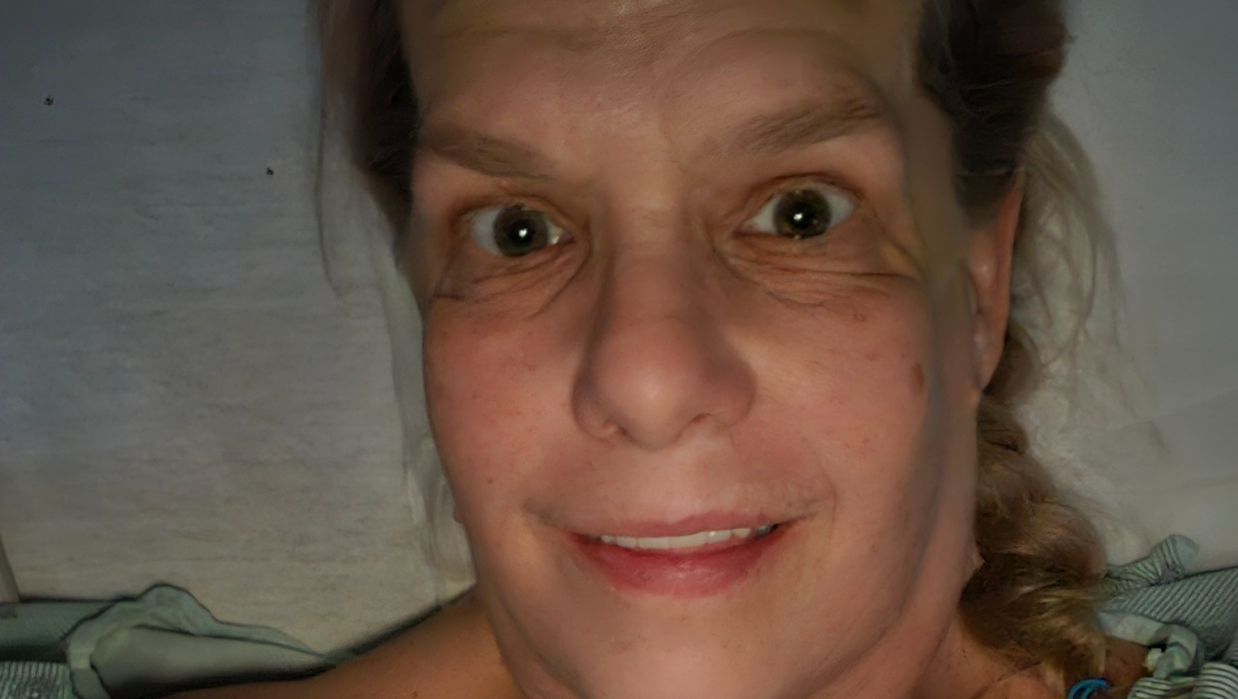 Fundraiser by Amy Torres : Standing with Amy during recovery from ...