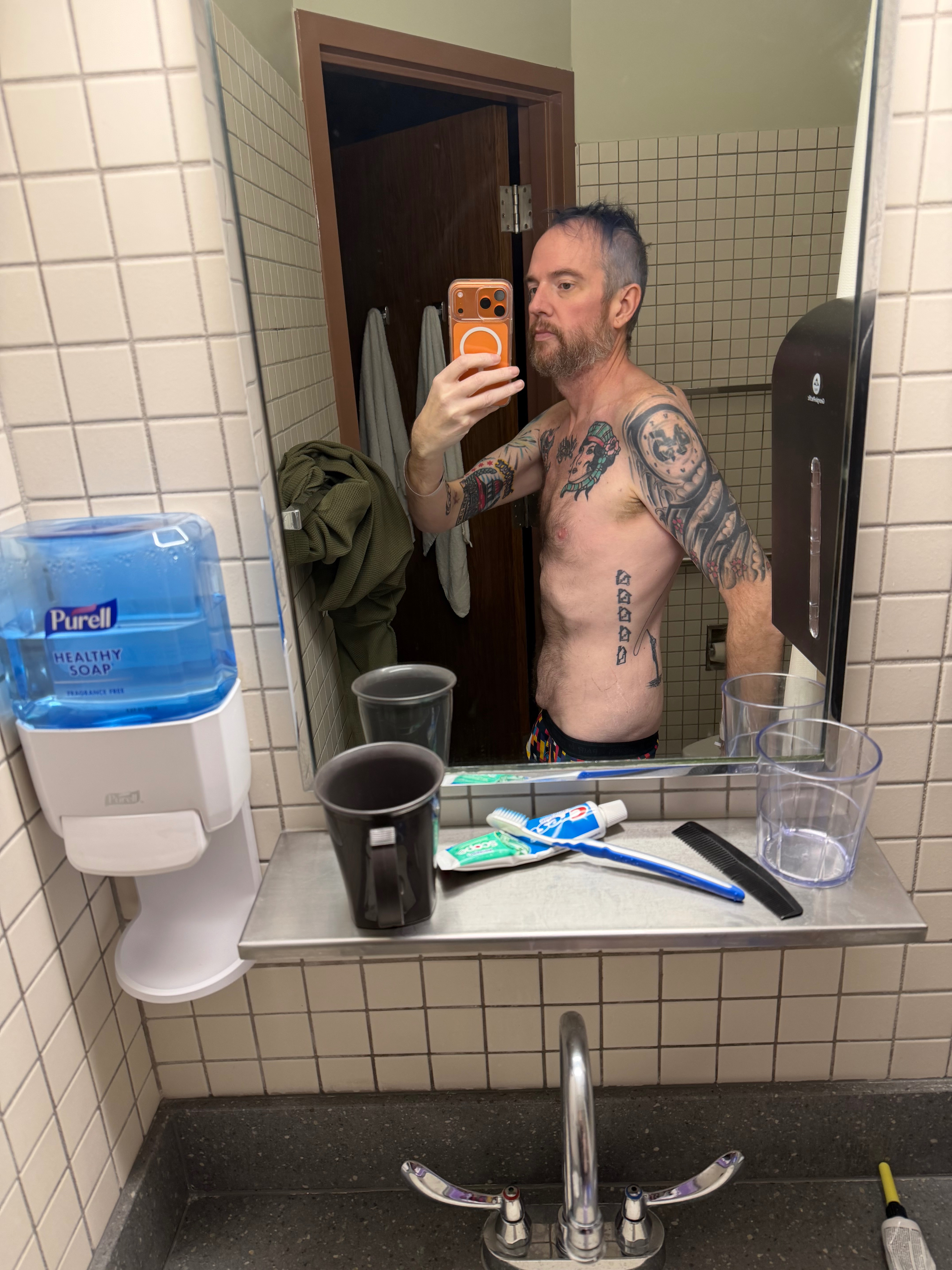 Fundraiser by Ryan Cox : Support Ryan's Fight Against Pancolitis