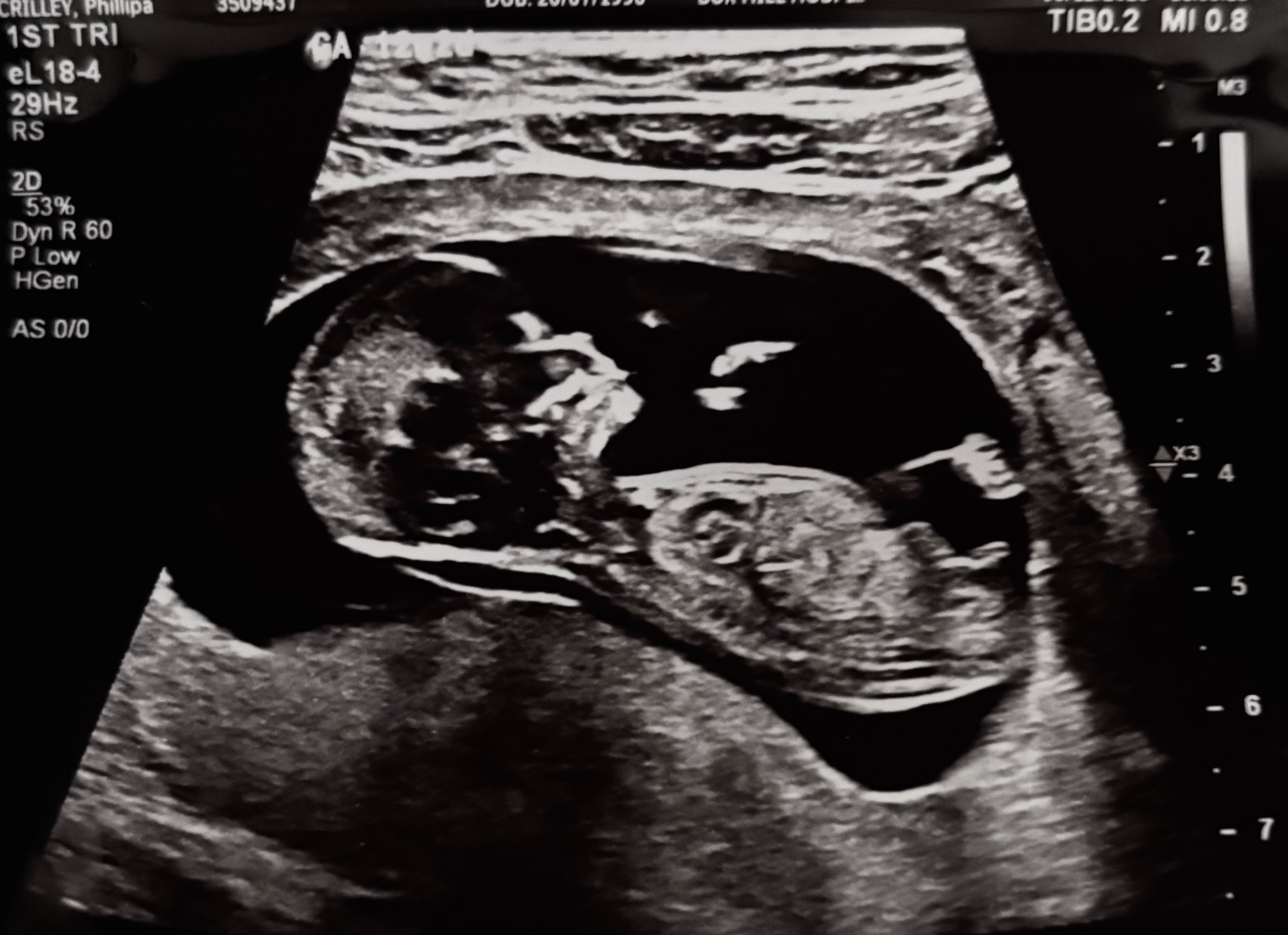 Fundraiser by Spencer Ratliff : Flip and Lloyd