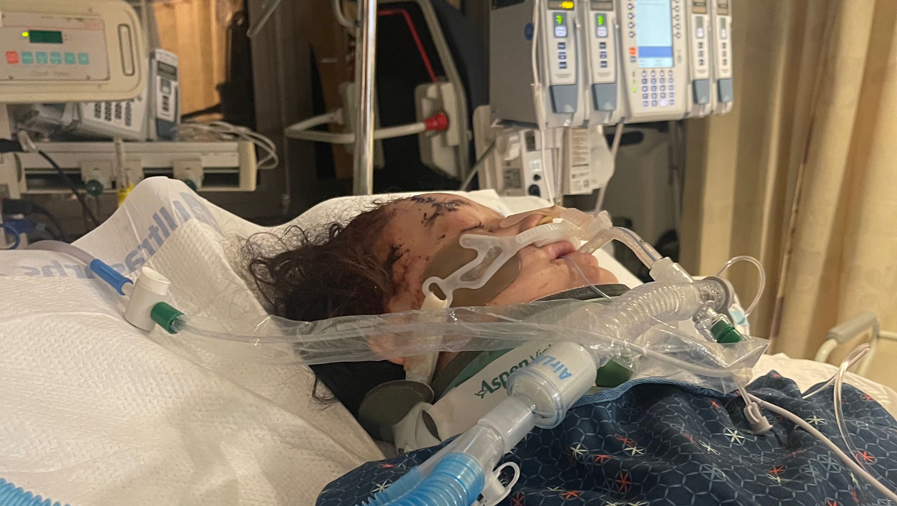 Fundraiser by Anrada Price : Support for Haylee Beck’s Recovery