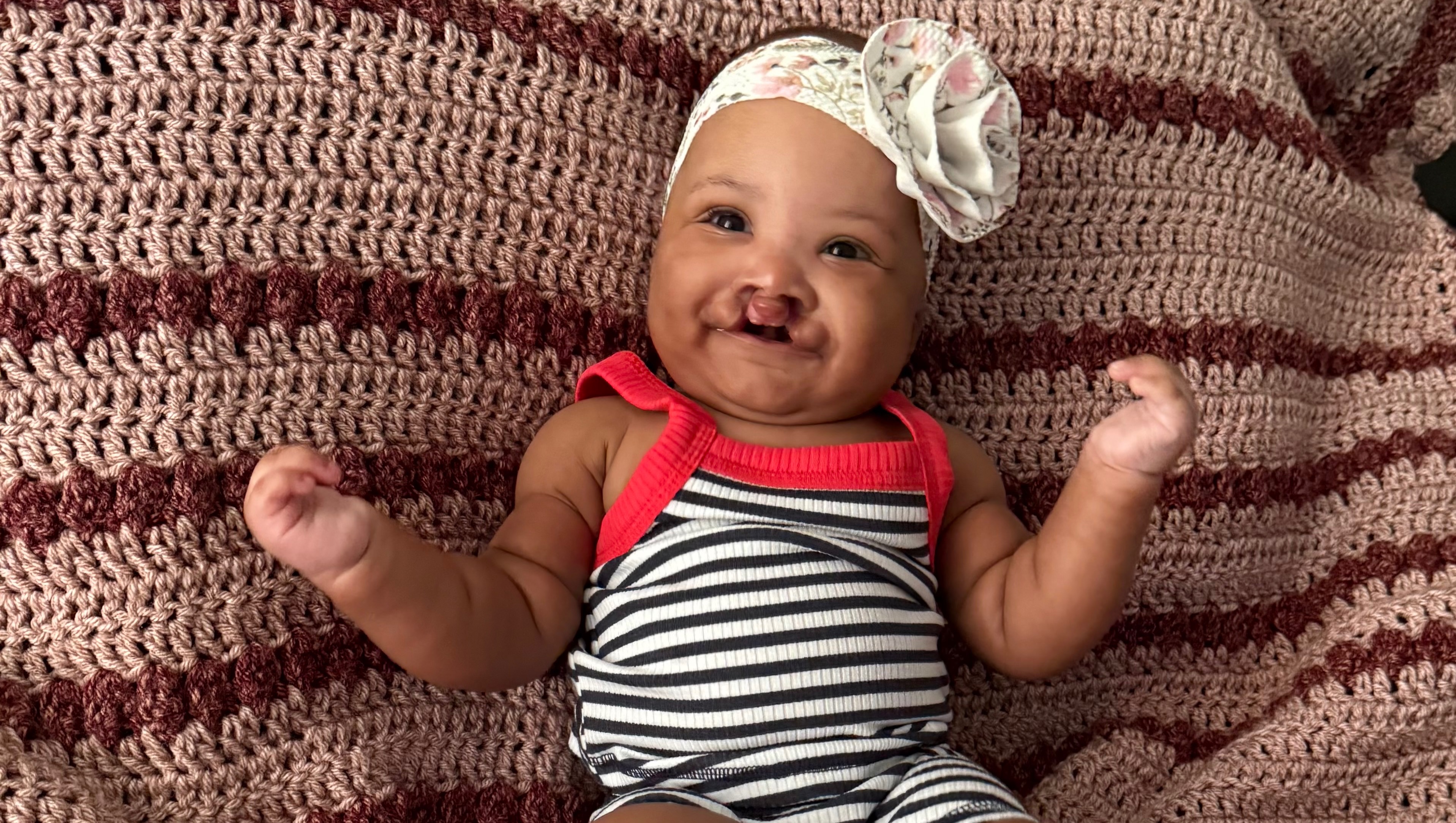 Fundraiser by Shena Smith : Support Surgeries for Baby Aniala