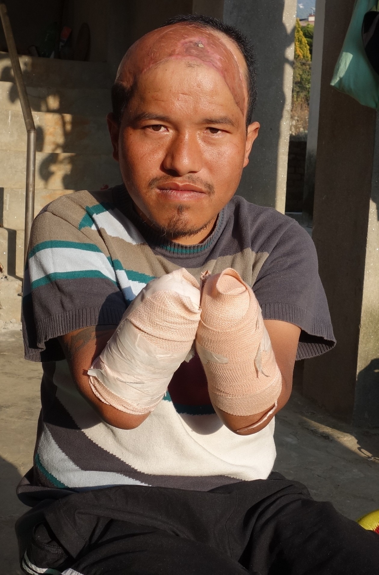 Fundraiser by Mywayimpact Ratna Tamang : Cooking Without Hands ...