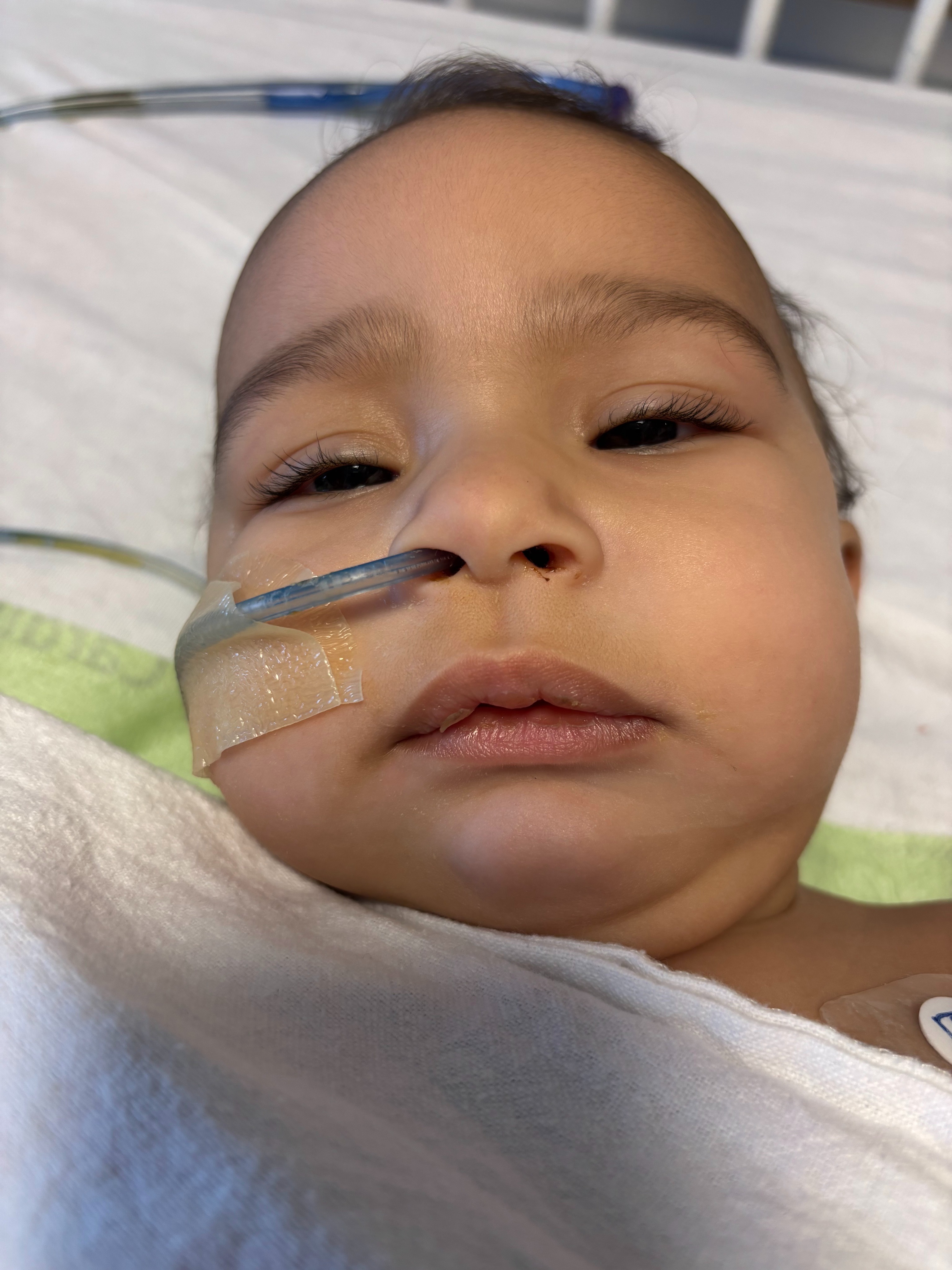 Fundraiser for Haylee Tigner by Kelly Tigner : Help Iris Recover After ...