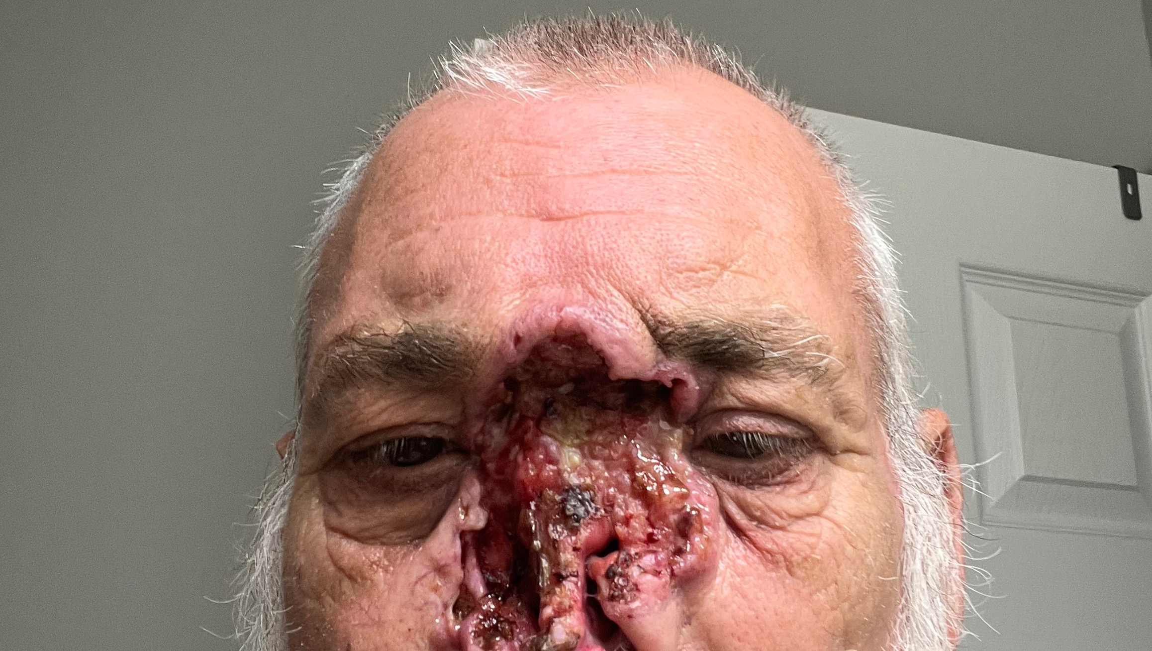 Fundraiser by Richard Conley : Help Richard Fight Cancer and Keep His Home