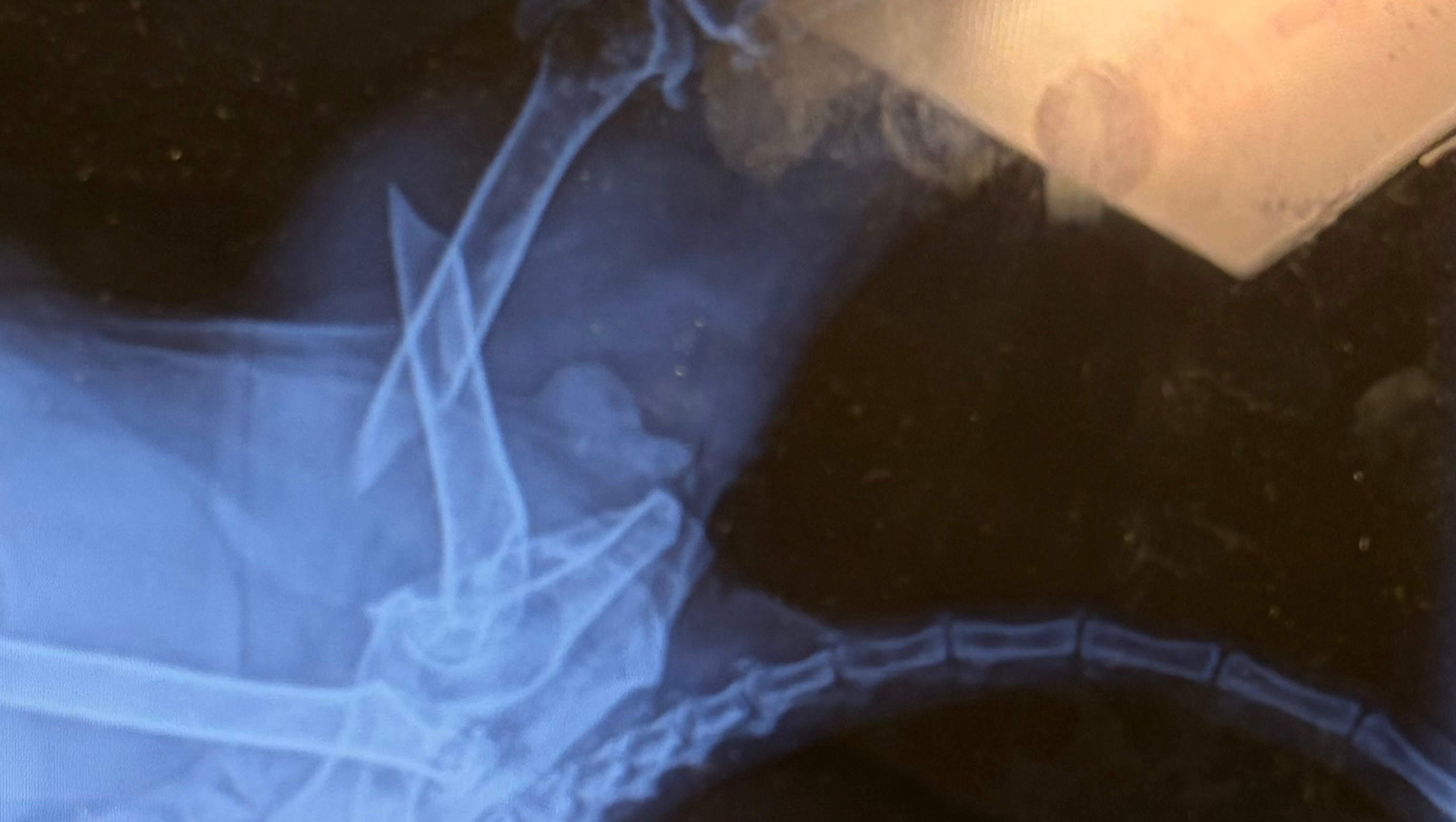 Fundraiser by lilly Ellis420 : Help Michael Get Femur Surgery and Heal