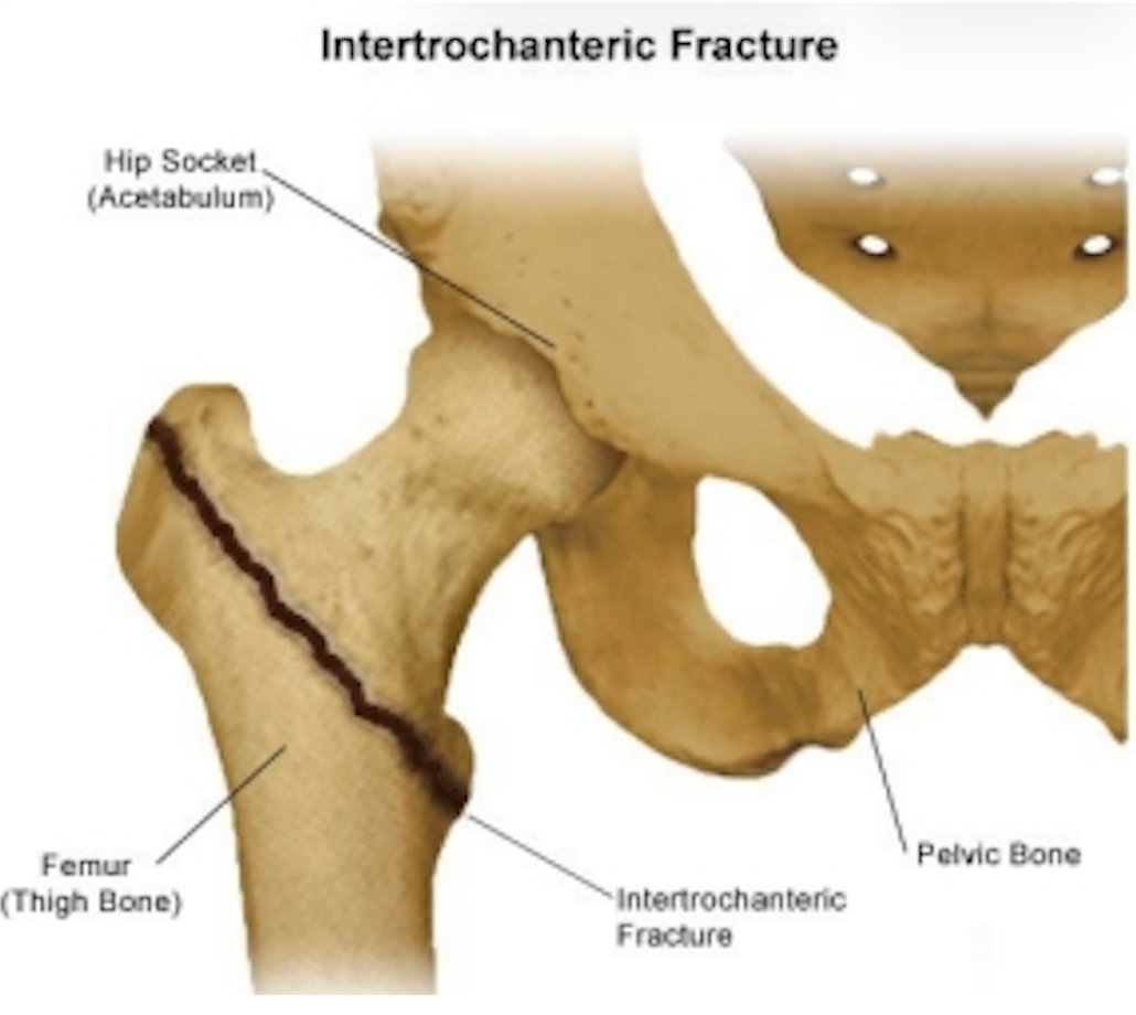 Fundraiser by Christine Mouzong : Help Michelle & John Stay Afloat ...
