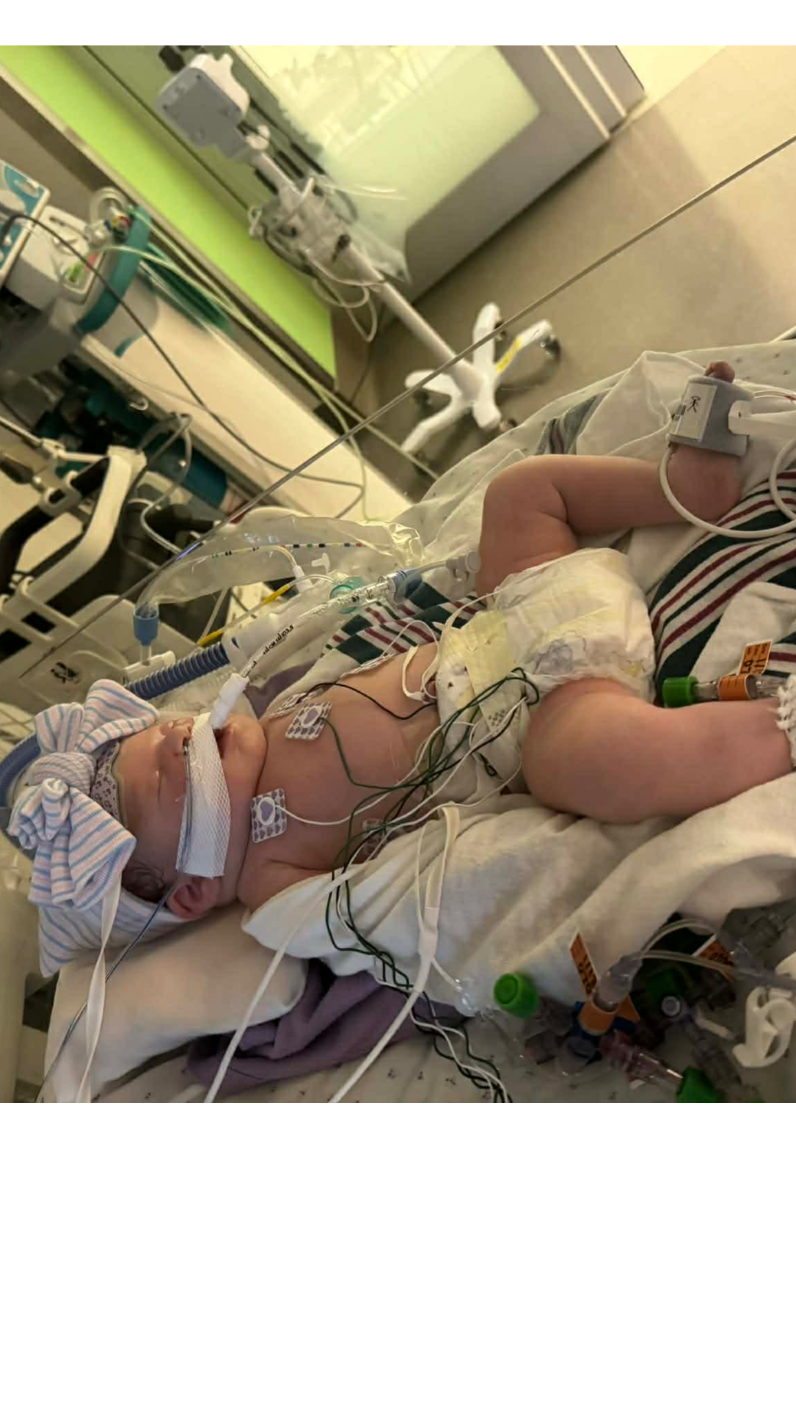 Fundraiser by Amy Green : Support Baby McKensey’s Heart Surgery Journey