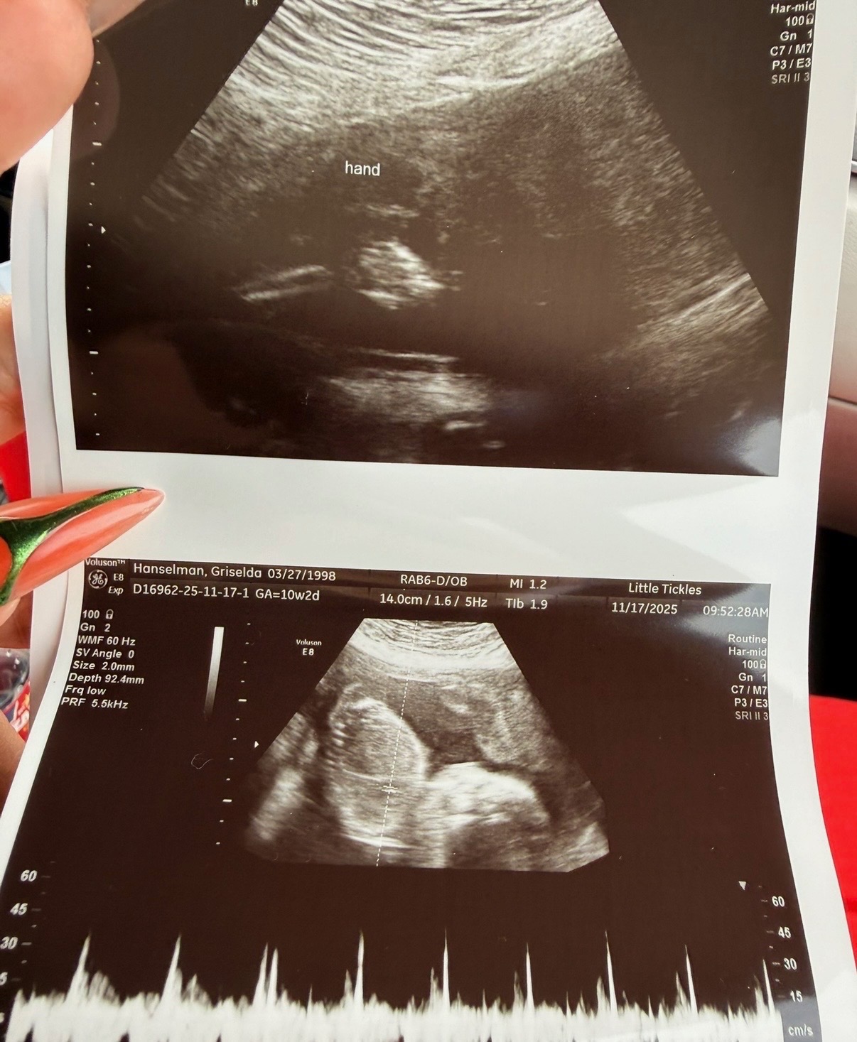 Fundraiser by Bernadette Hanselman : Support for Gris and Baby Girl's ...