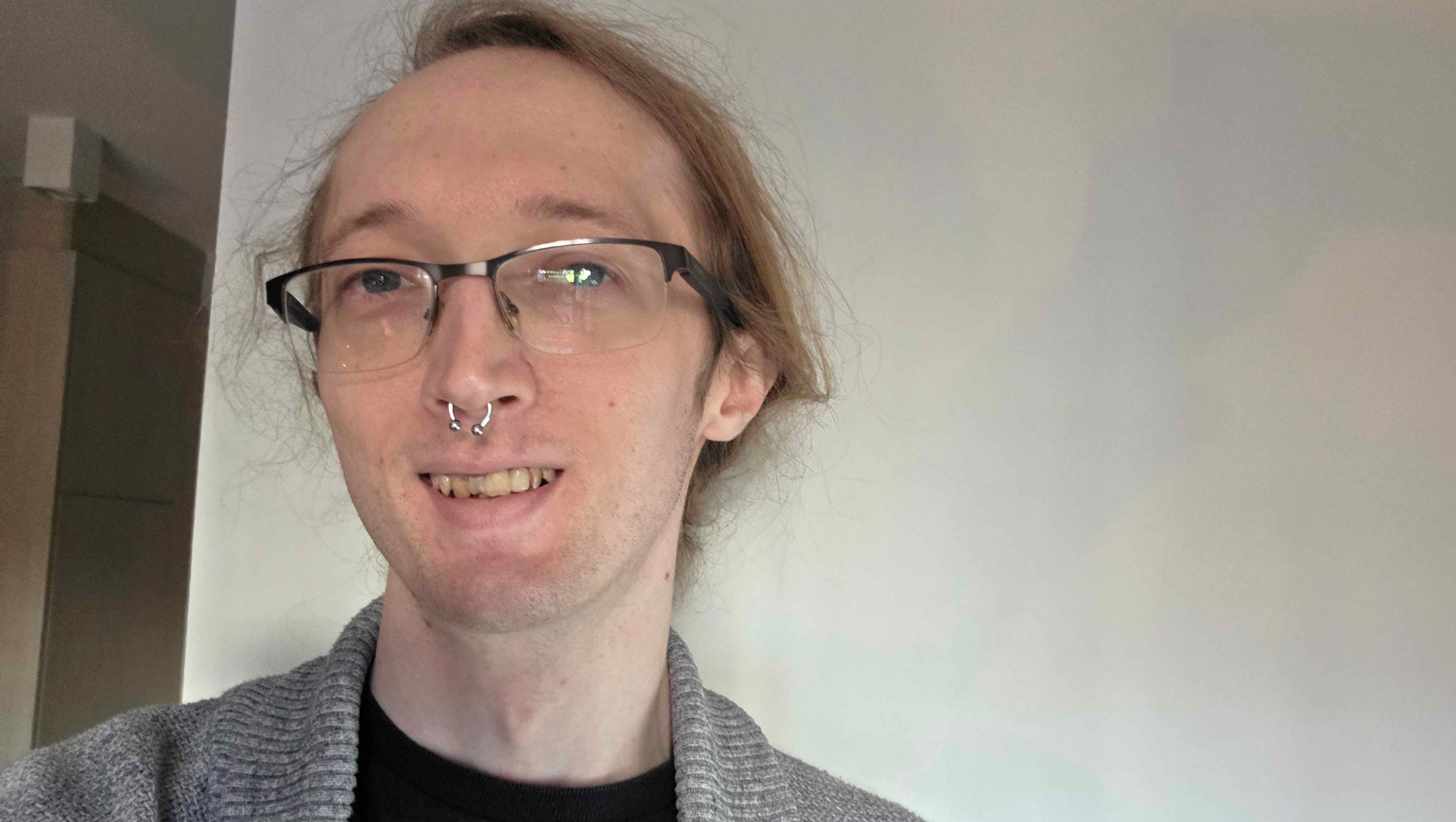 Fundraiser by Christopher Albro : Help Chris Get Urgent Dental Treatment