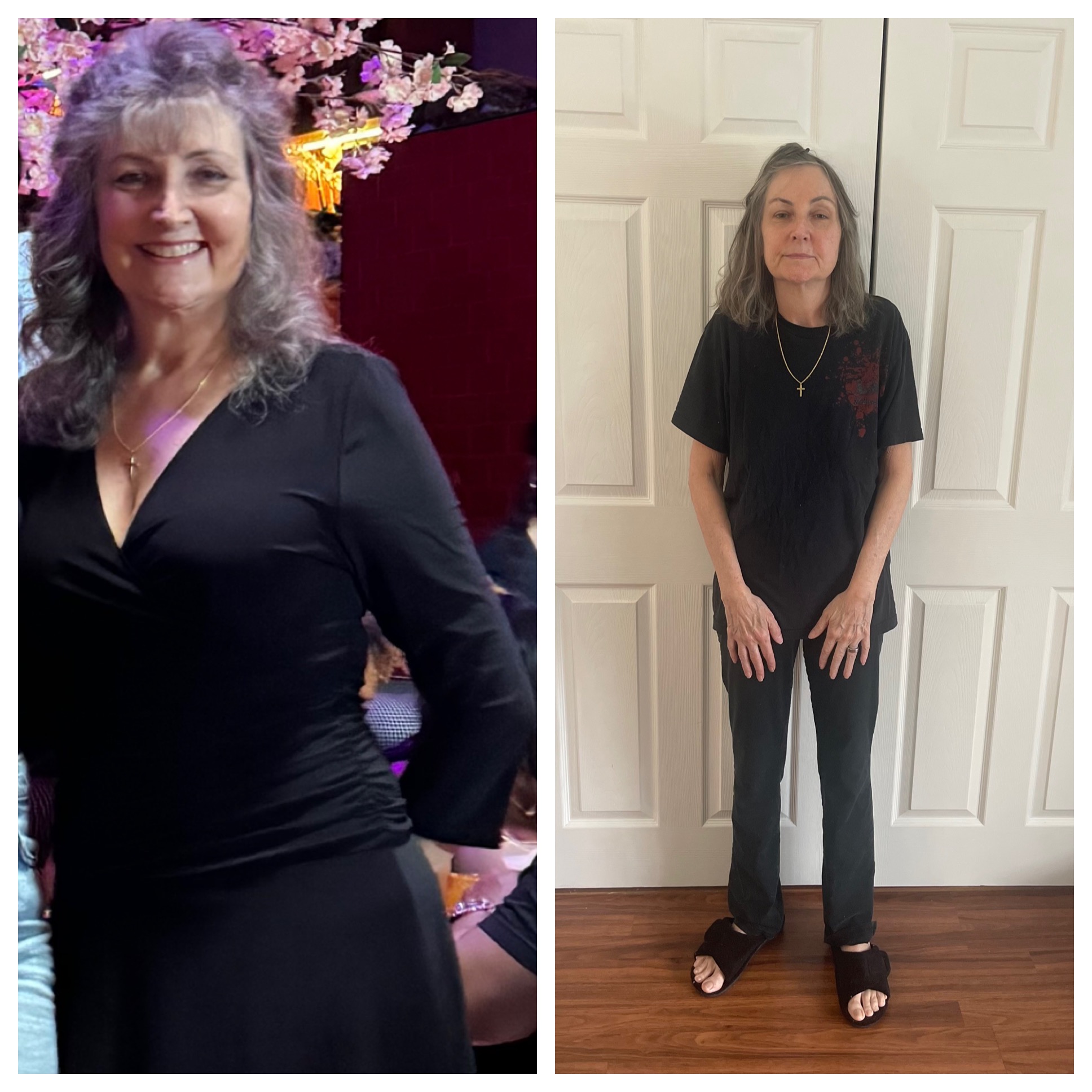 Fundraiser by Charlie Thornton : Help Renee Get the Care She Deserves