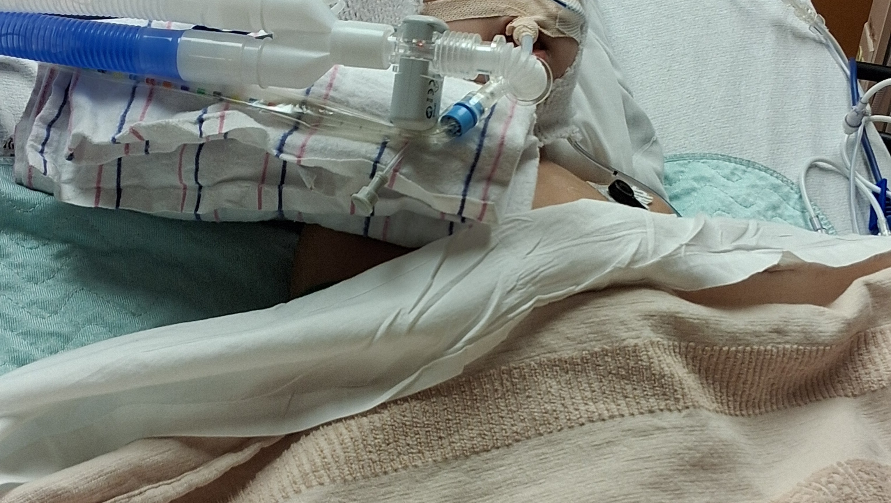 Fundraiser by Ploua Vang : Support Mason's Fight Against Cancer
