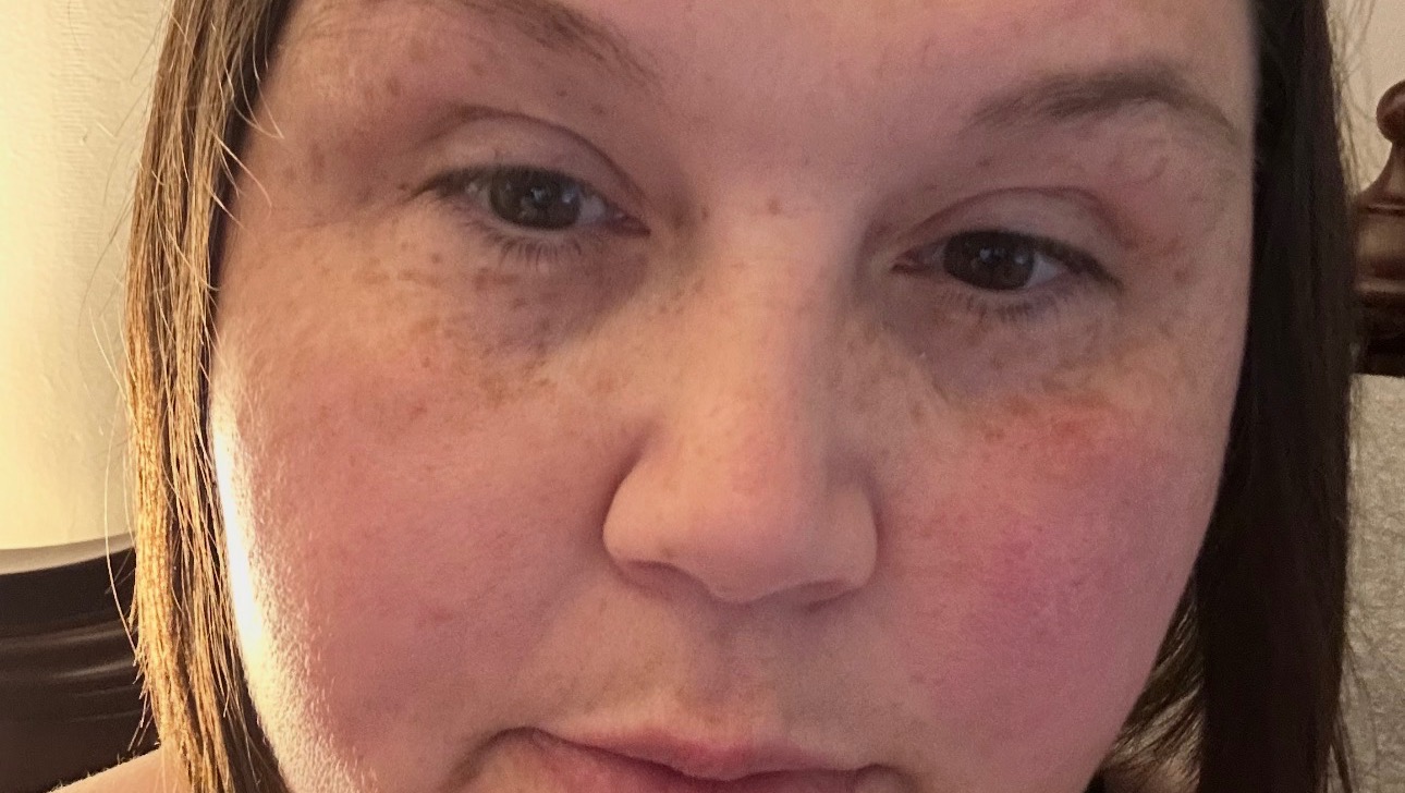 Fundraiser for Heather McLamb by Tracy Fowler : Help Heather with ...