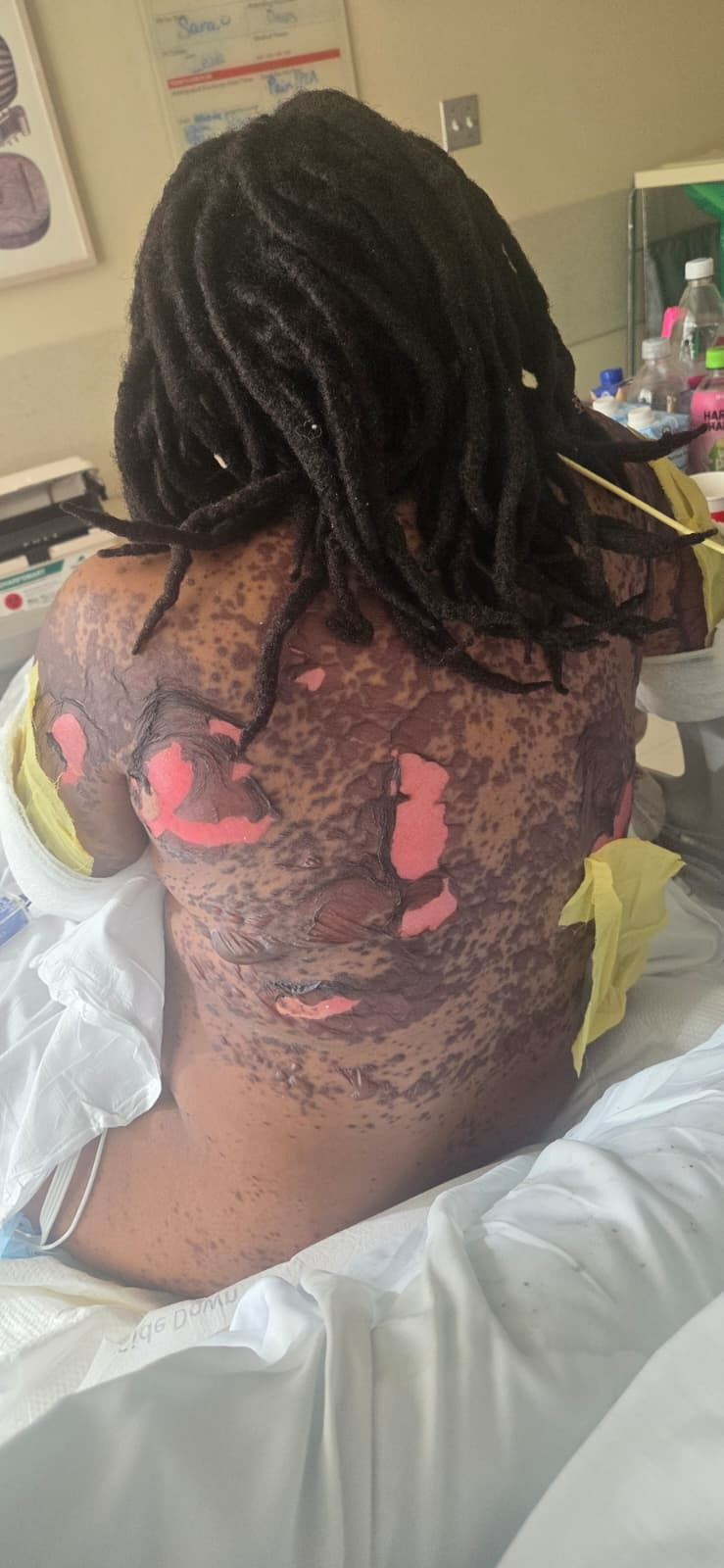 Fundraiser for Angela Auguste by Dimitrious Davis : Help Angie Heal ...