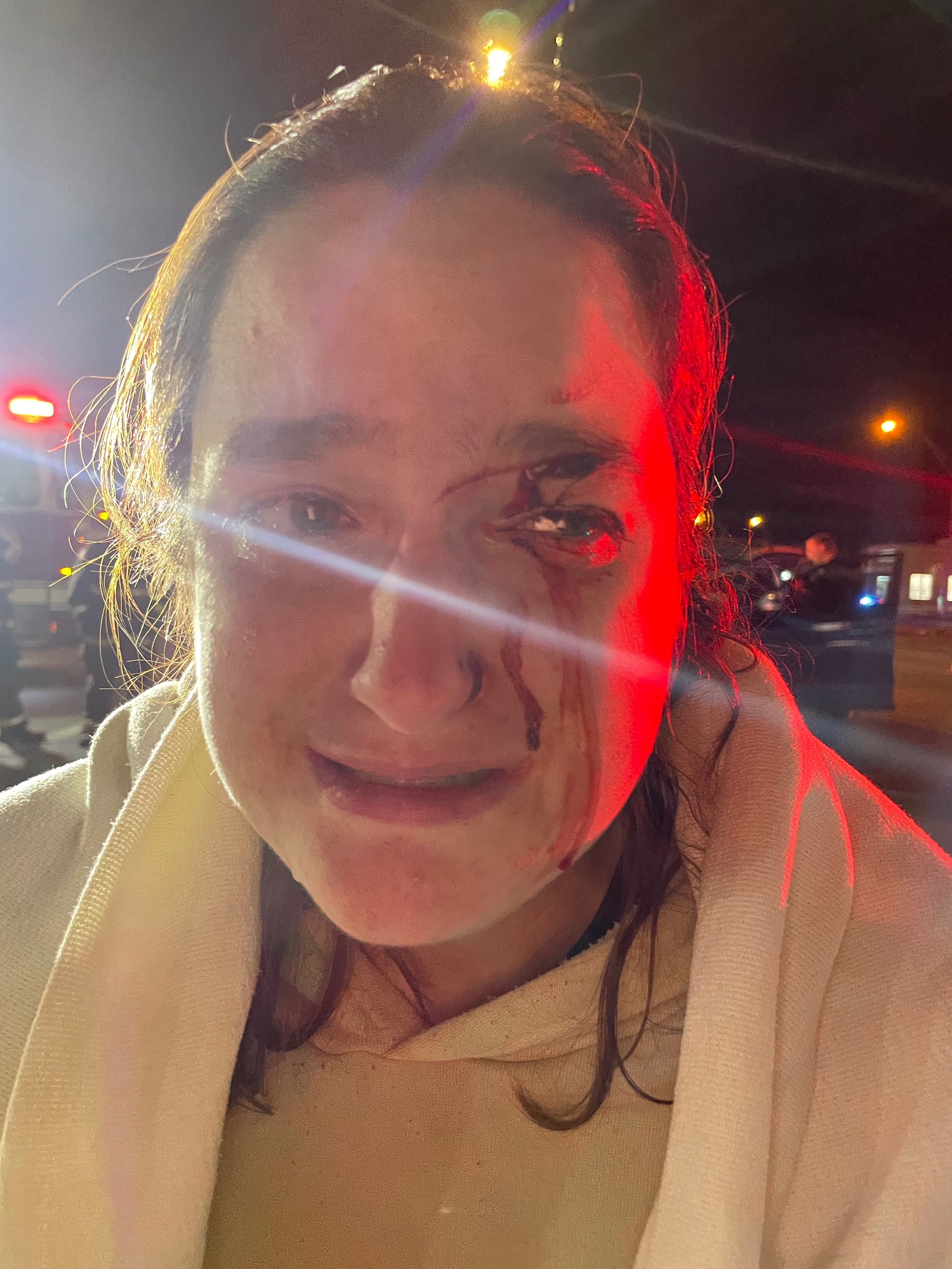 Fundraiser for Deeanna Price by Michael Price : Help Deeanna After Hit ...