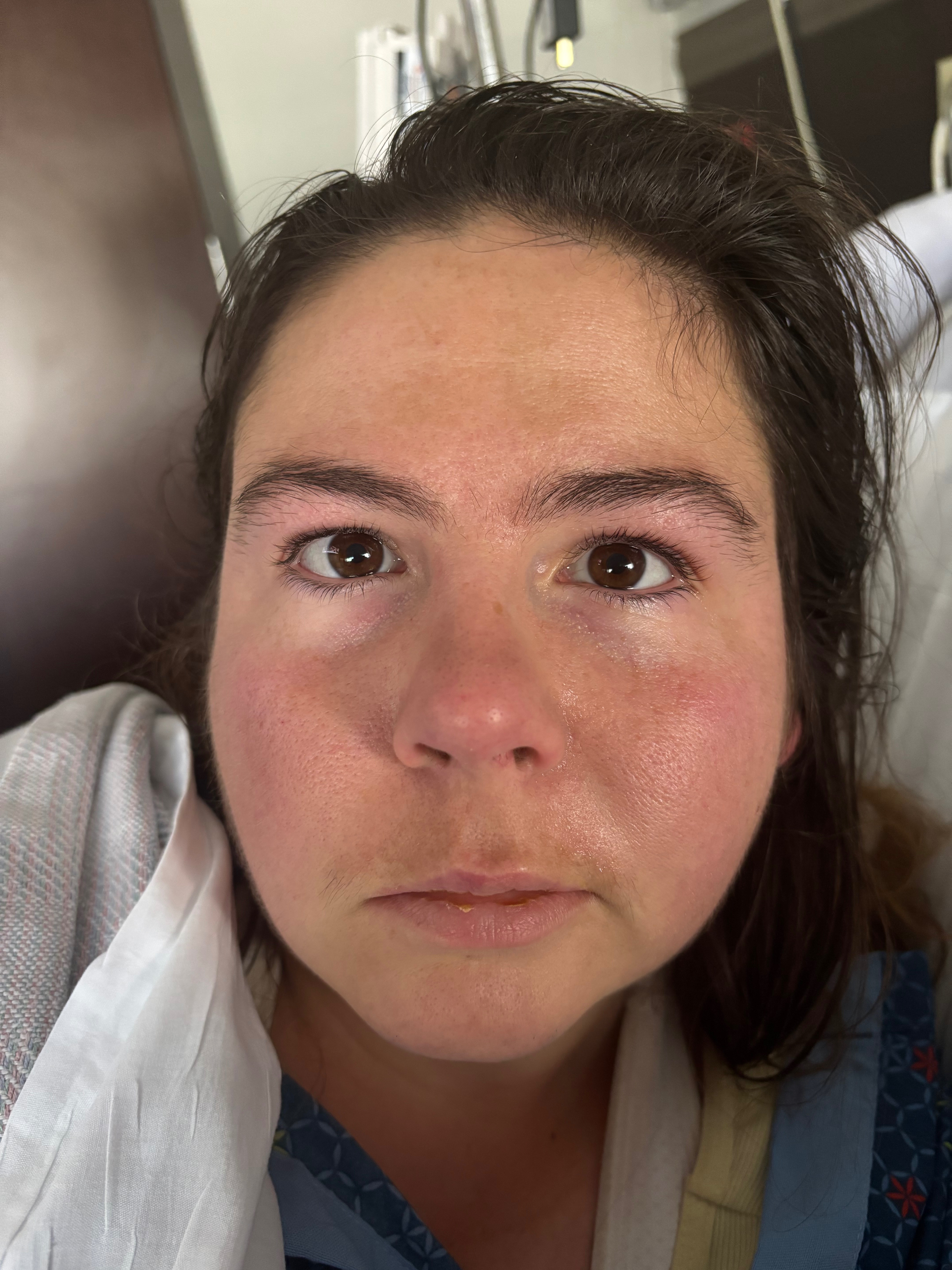 Fundraiser by Michele Lappan : Help Kourteney receive treatment at ...
