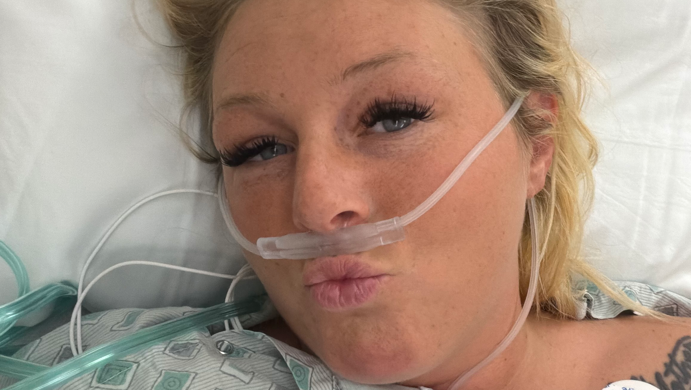 Fundraiser by Lexi Schlumpf : Support Lexi's Recovery from Work Injury