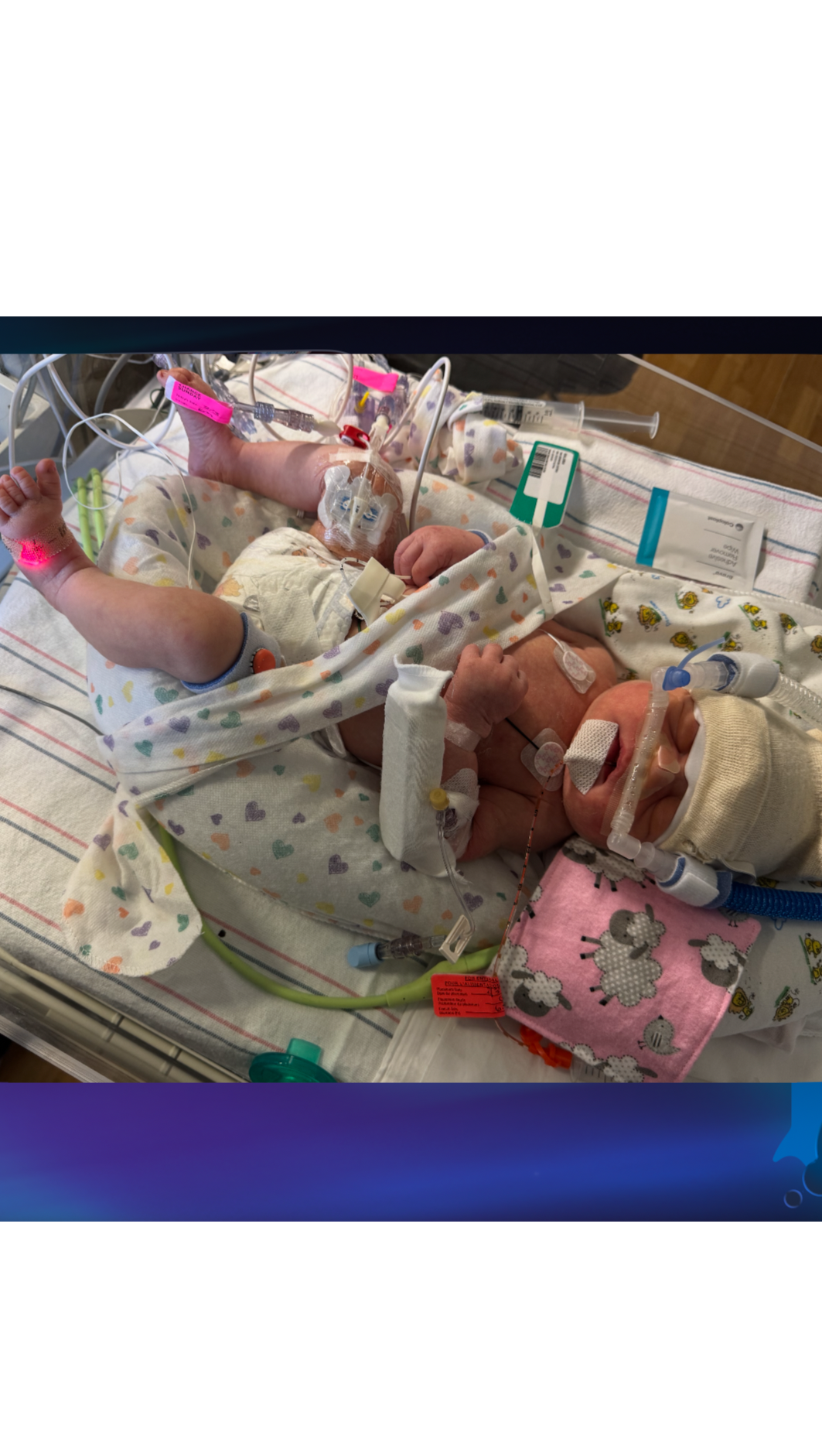 Fundraiser for Joshua Burk by Tim Burk : Support Baby Logan's Battle ...