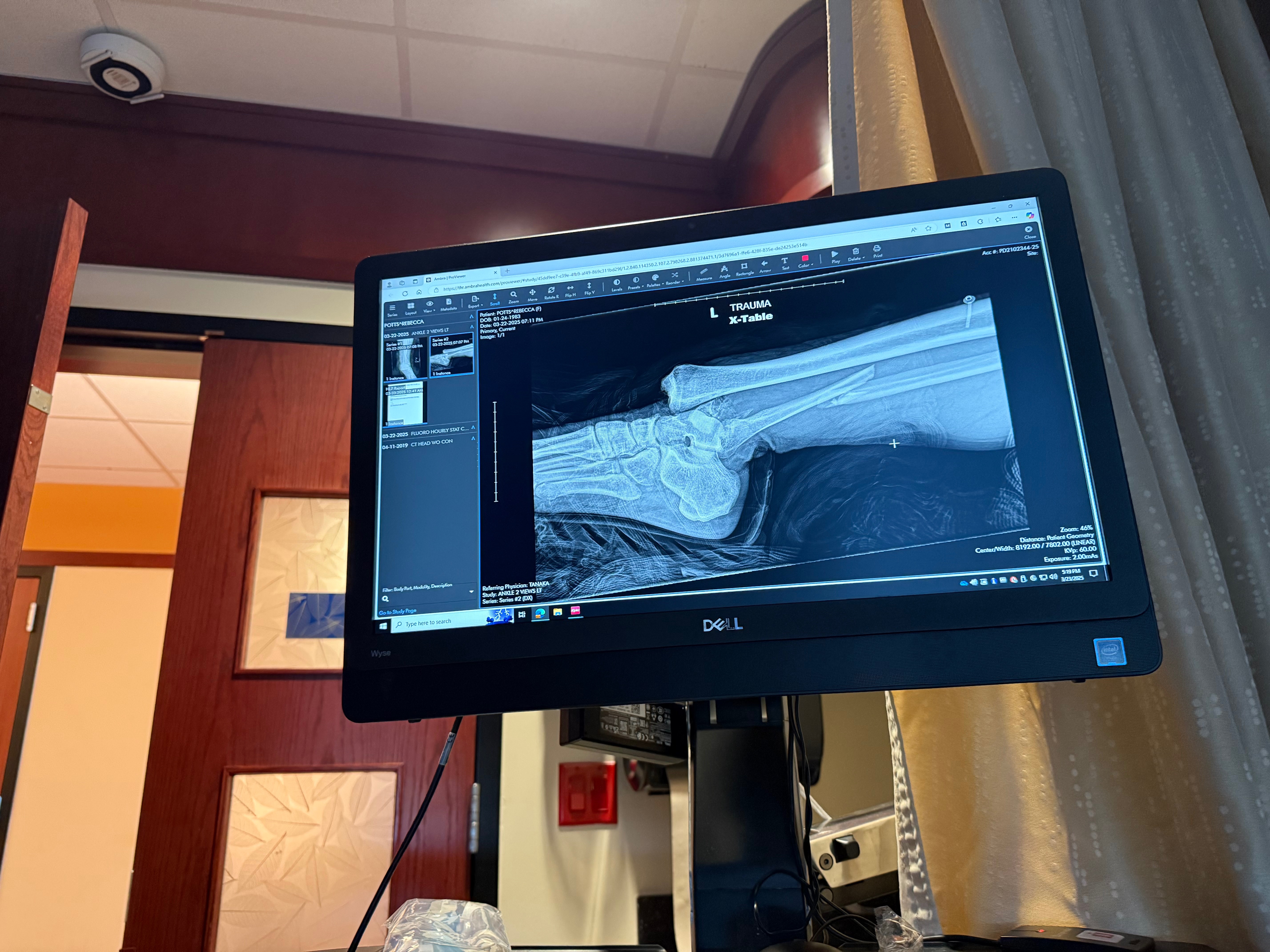 Fundraiser by Rebecca Potts : Help Save My Ankle and Support My Family