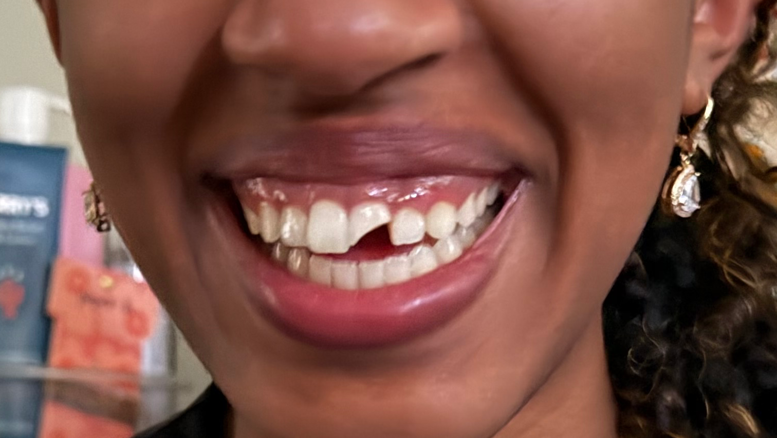 Fundraiser for Gabrielle Makonnen by mackenzie lewis : Help Gabby Fix ...