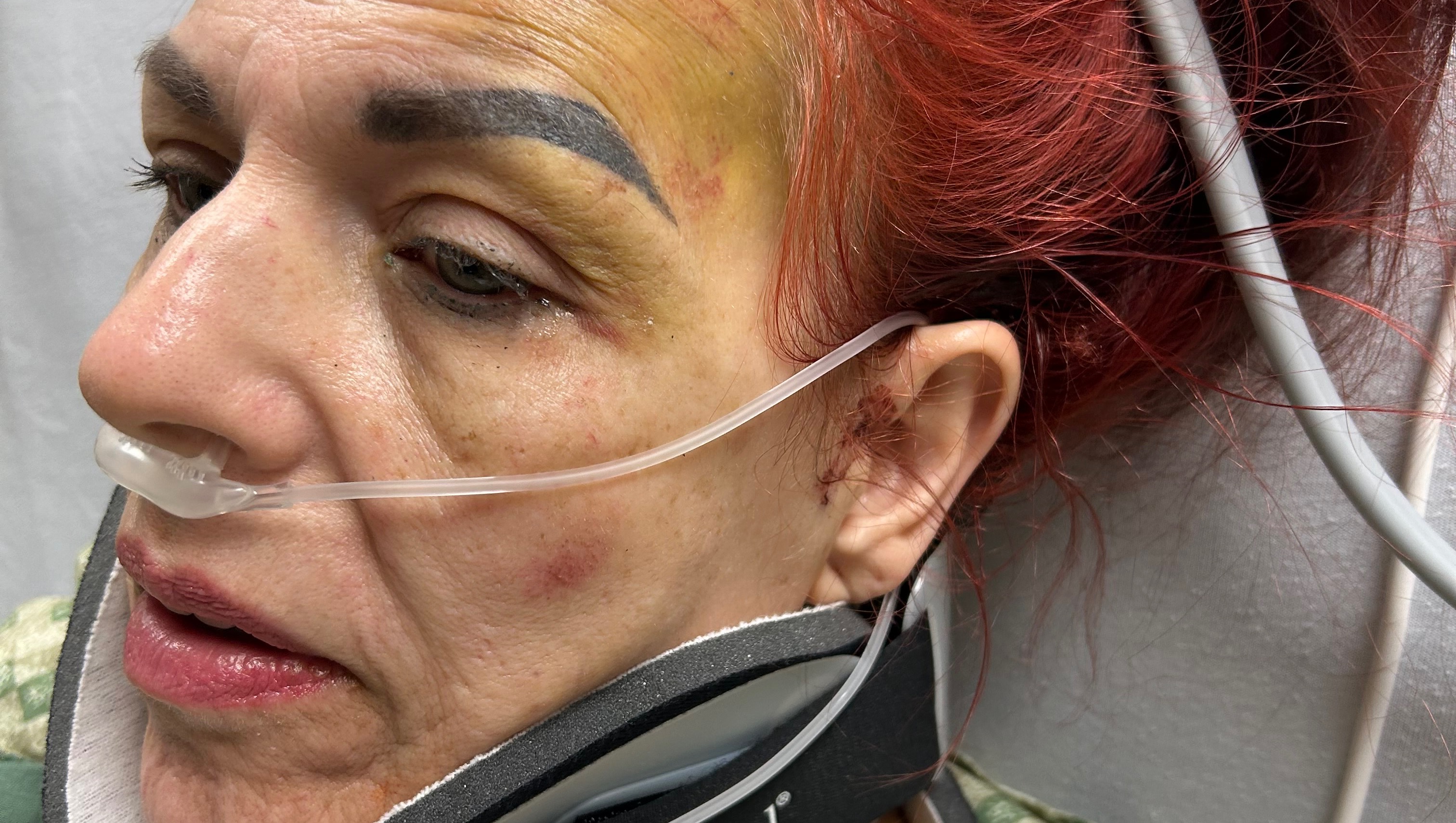 Fundraiser by Meredith Perduyn : Help Bobo Get Back On Her Feet