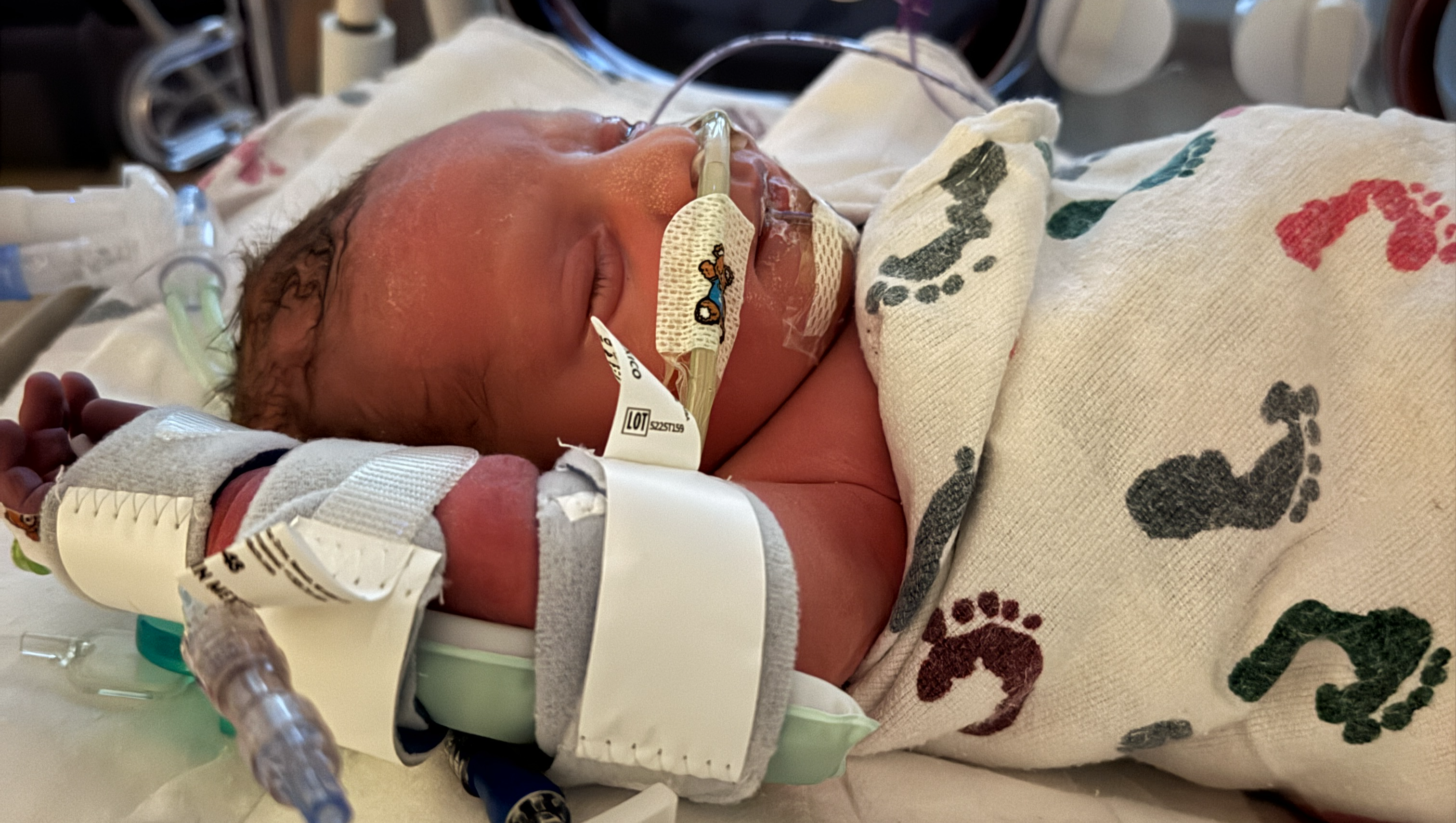Fundraiser for Brandon Klein by Emilyann Drumm : Support for Baby ...