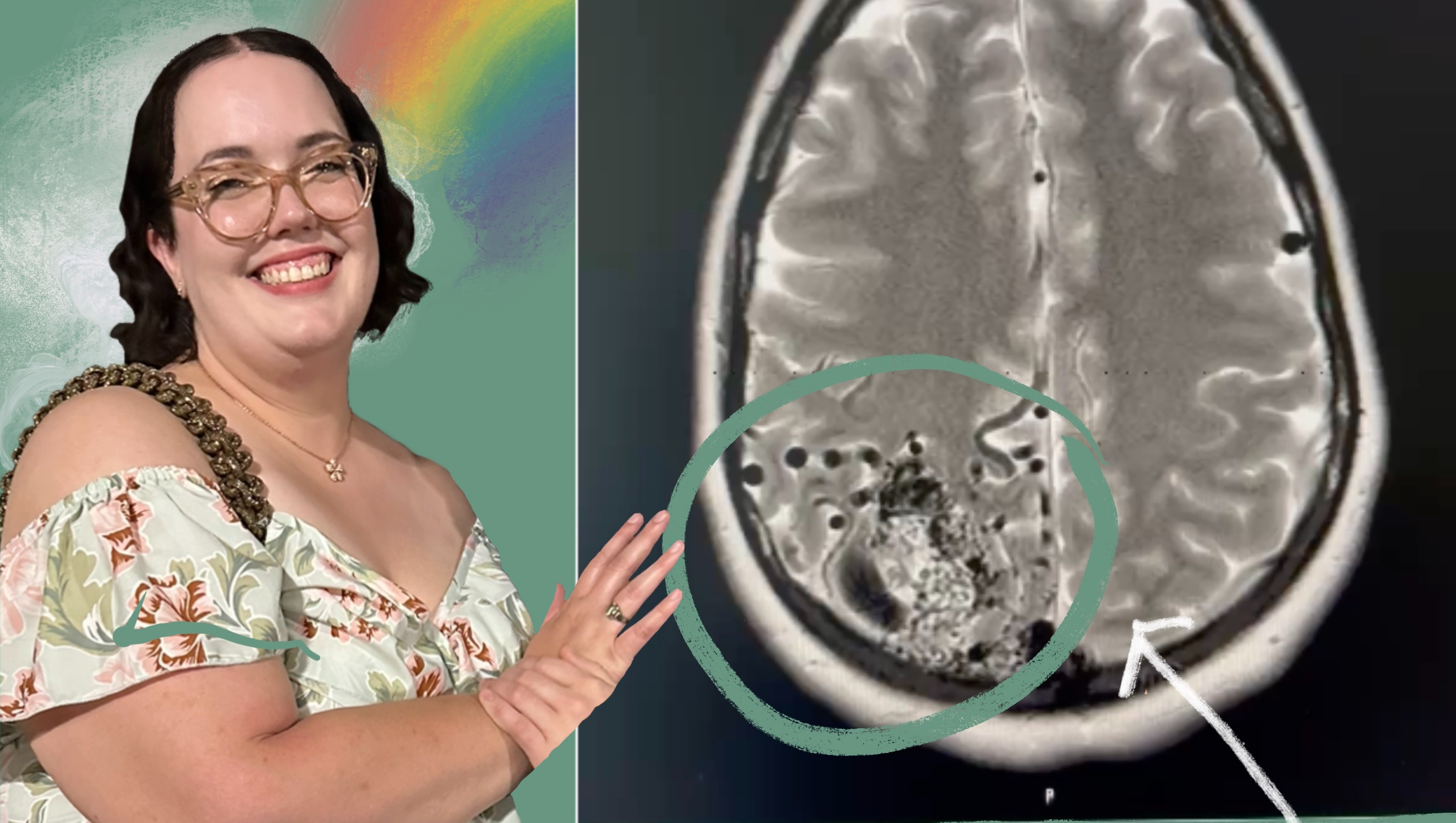 Fundraiser by Rachael Rush : Help Rachael Face a Life-Changing Brain AVM